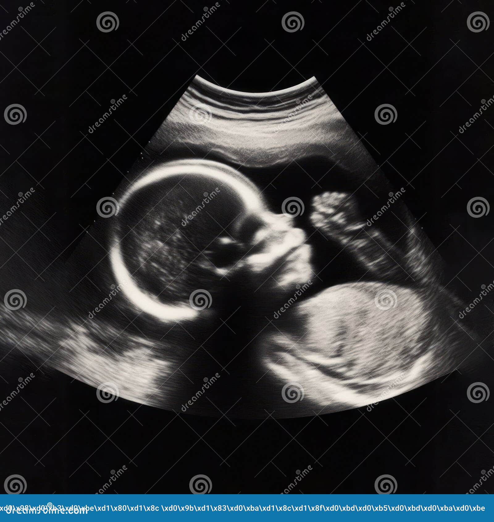 Ultrasound Of Baby. Embryo In Womb. Pregnancy Screening. Baby Health ...