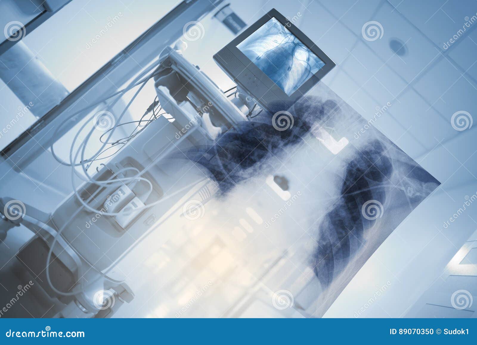 X-ray Unit with Chest Image in Hospital Stock Photo - Image of medicine ...