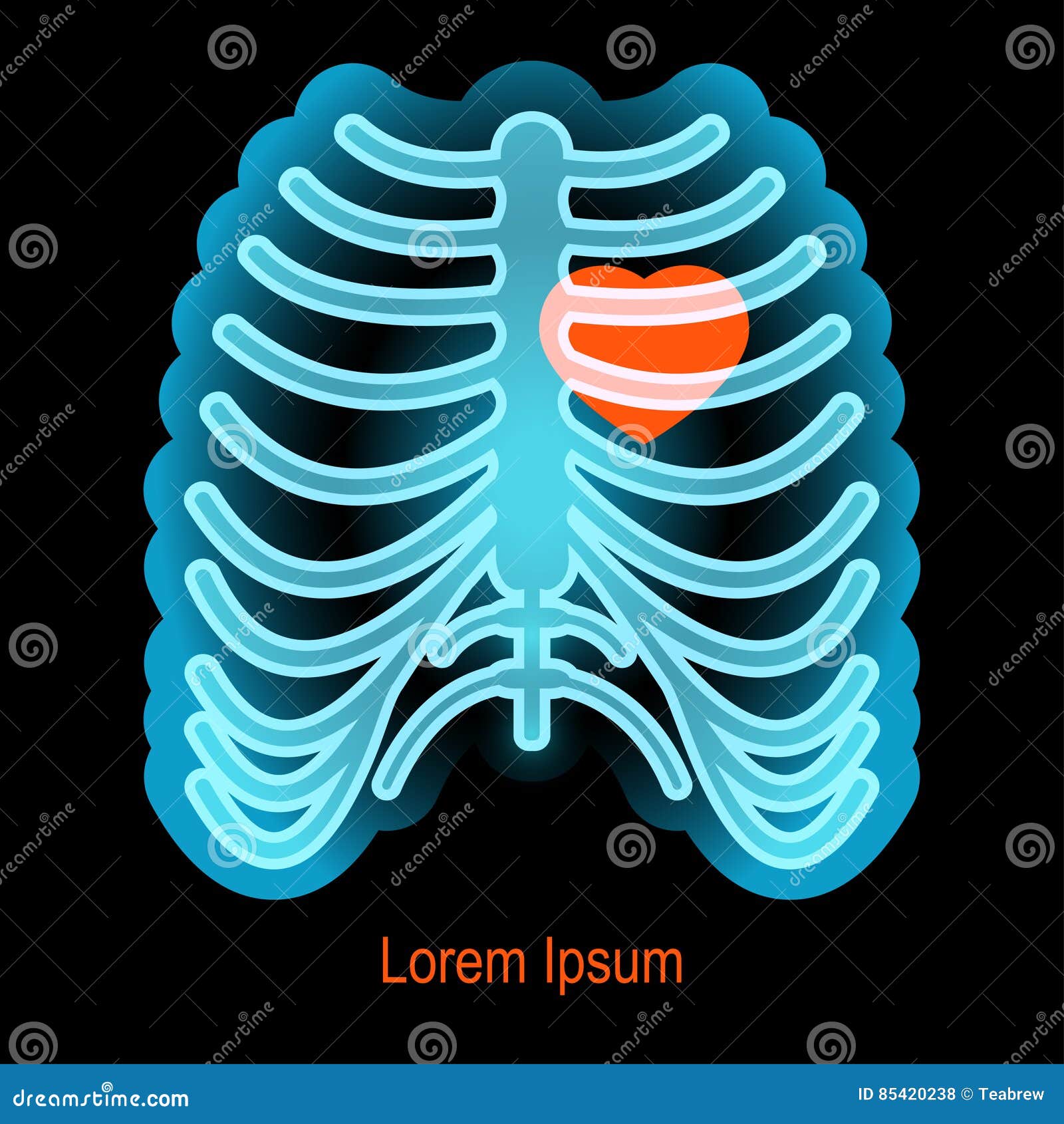 X-ray Vector illustration stock vector. Illustration of cartoon - 85420238