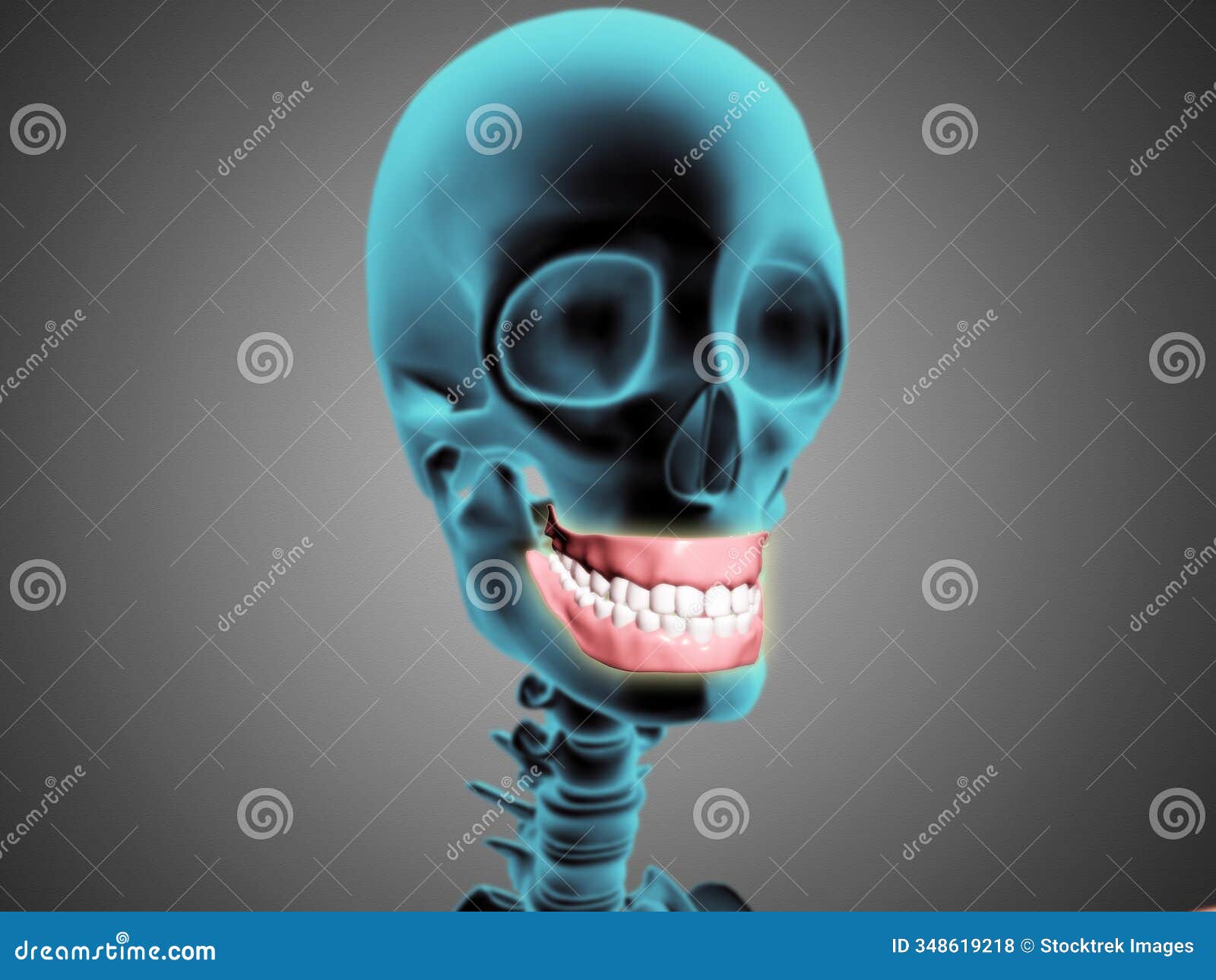 X-ray View of Human Skeleton Showing Teeth and Gums. Stock Illustration ...