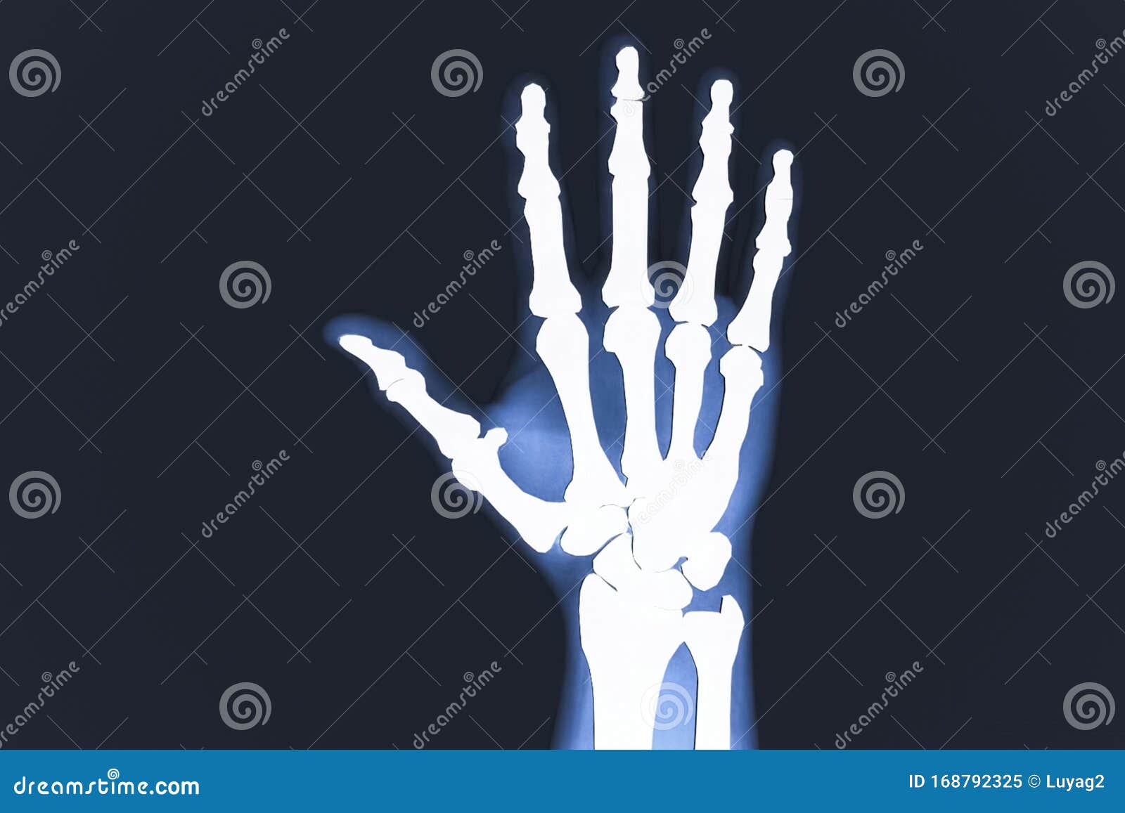 X Ray Hand Anatomy