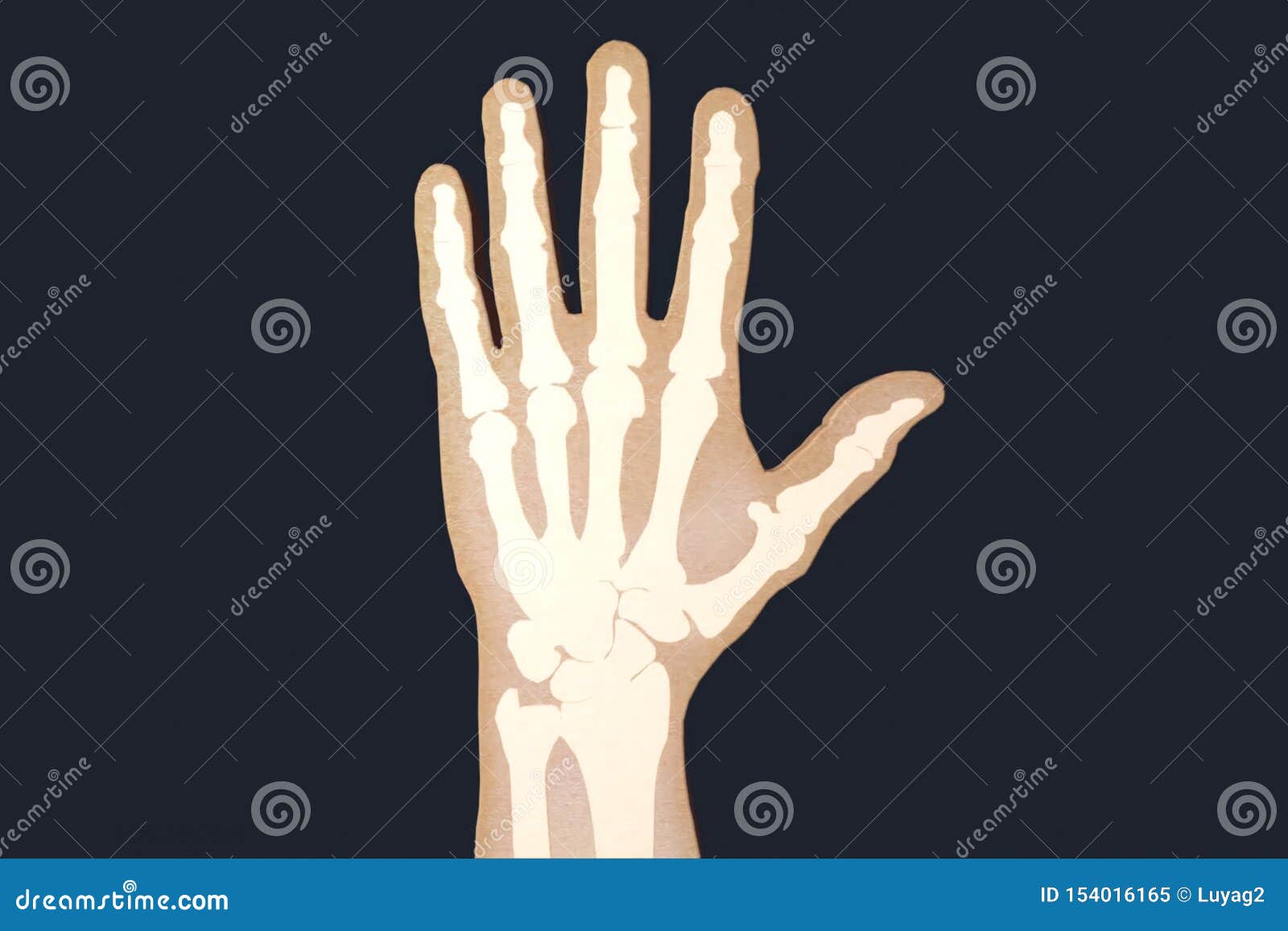 X-rayed Human Hand. X-ray of Hand Bones. Stock Image - Image of health ...