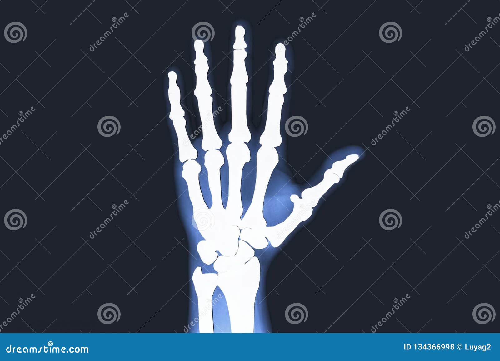 X-rayed human hand. stock photo. Image of diagnosis - 134366998