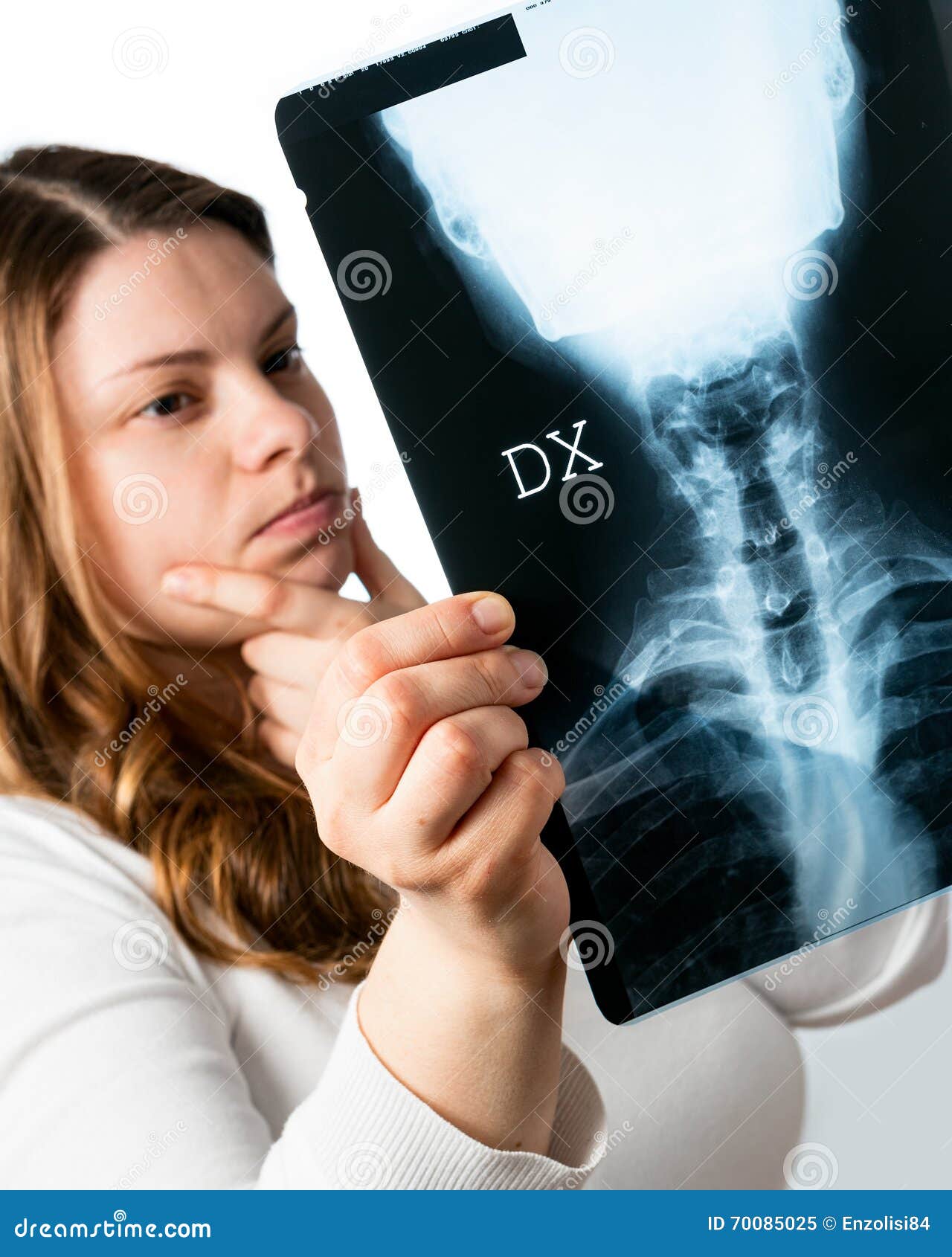 X -rays of the cervical stock image. Image of woman, care - 70085025