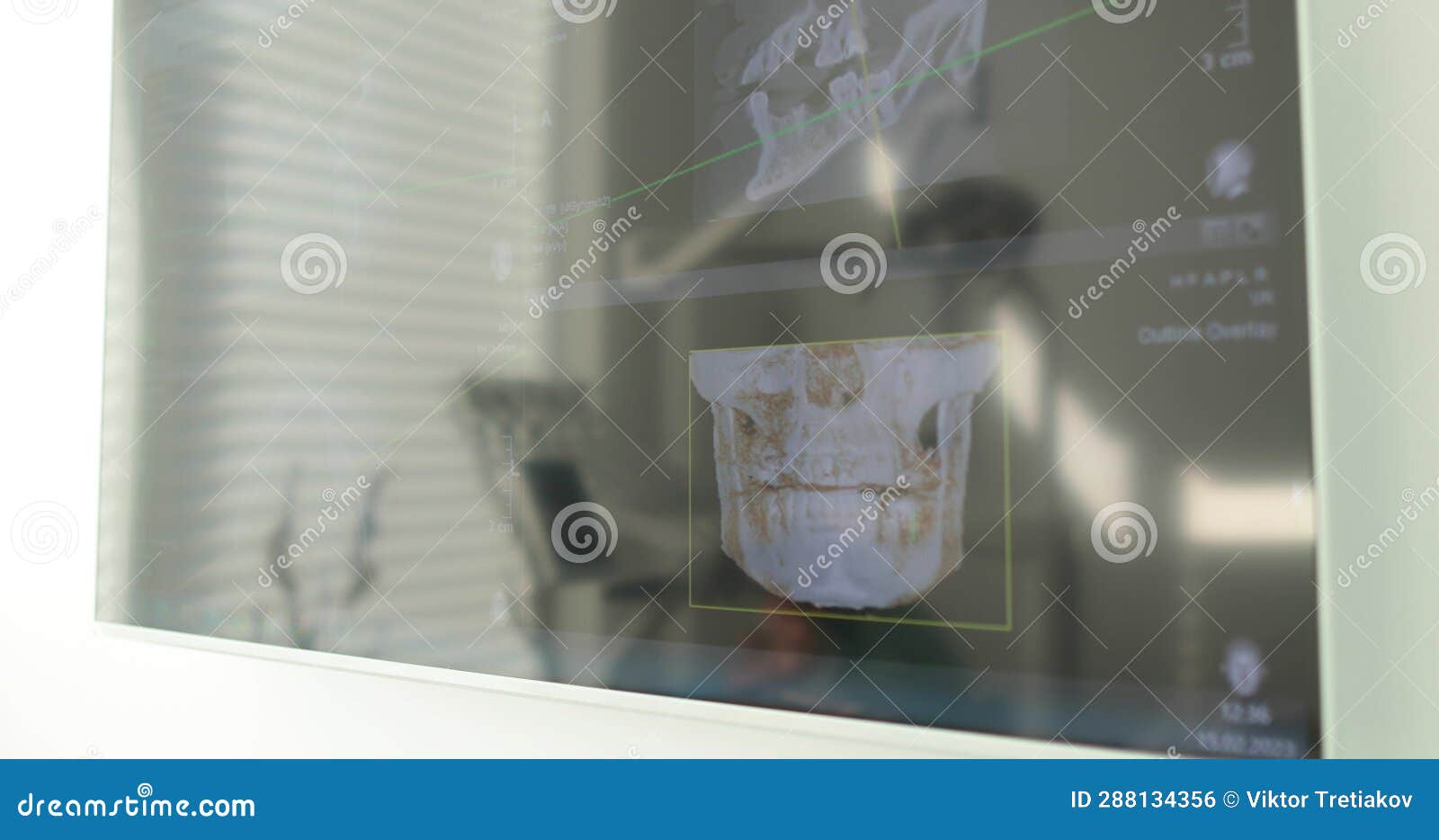 X-rays of the Jaws on the Screen in the Dental Office. Stock Photo ...