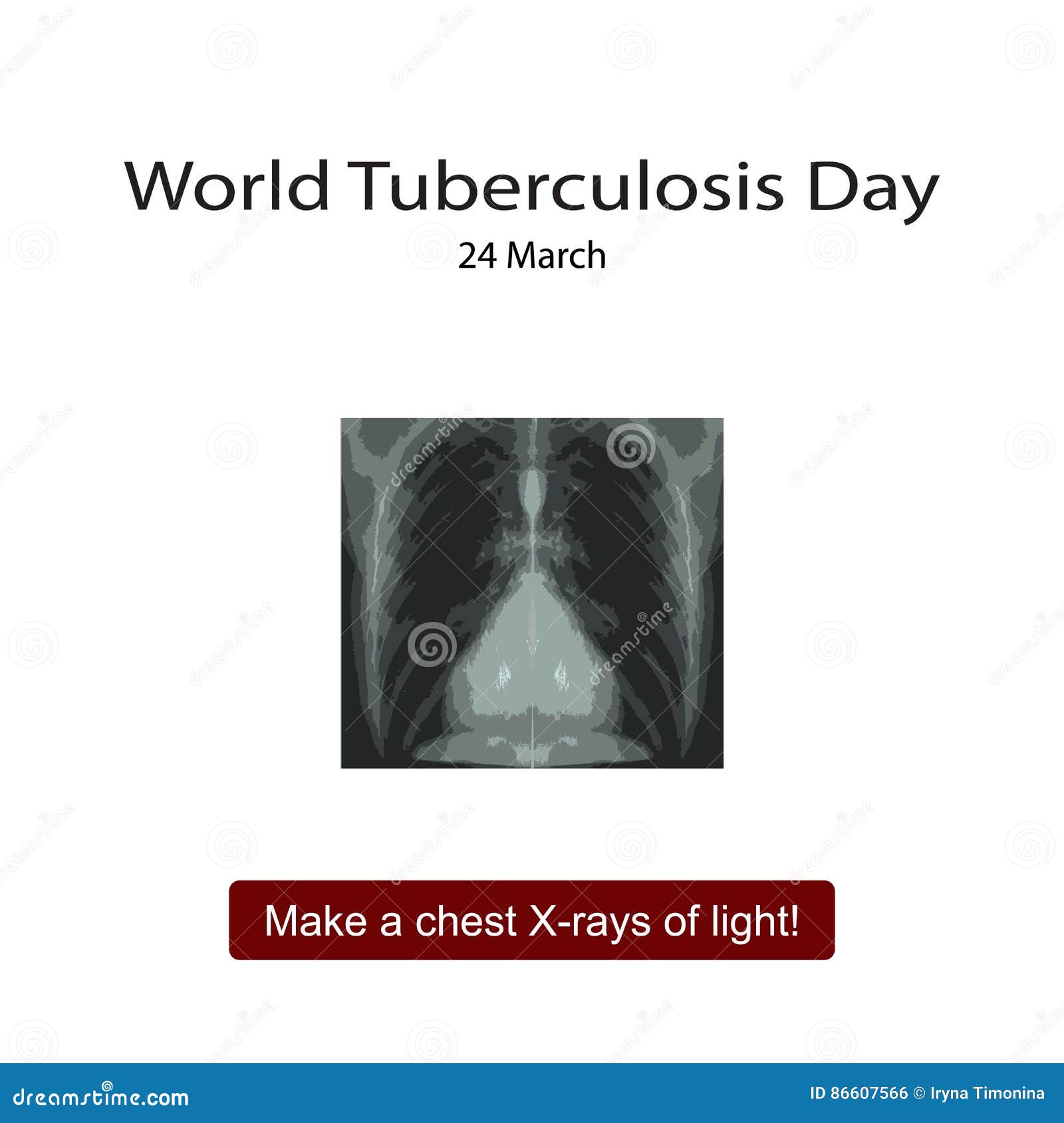 Tuberculosis (TB) Infographics Vector Illustration | CartoonDealer.com ...