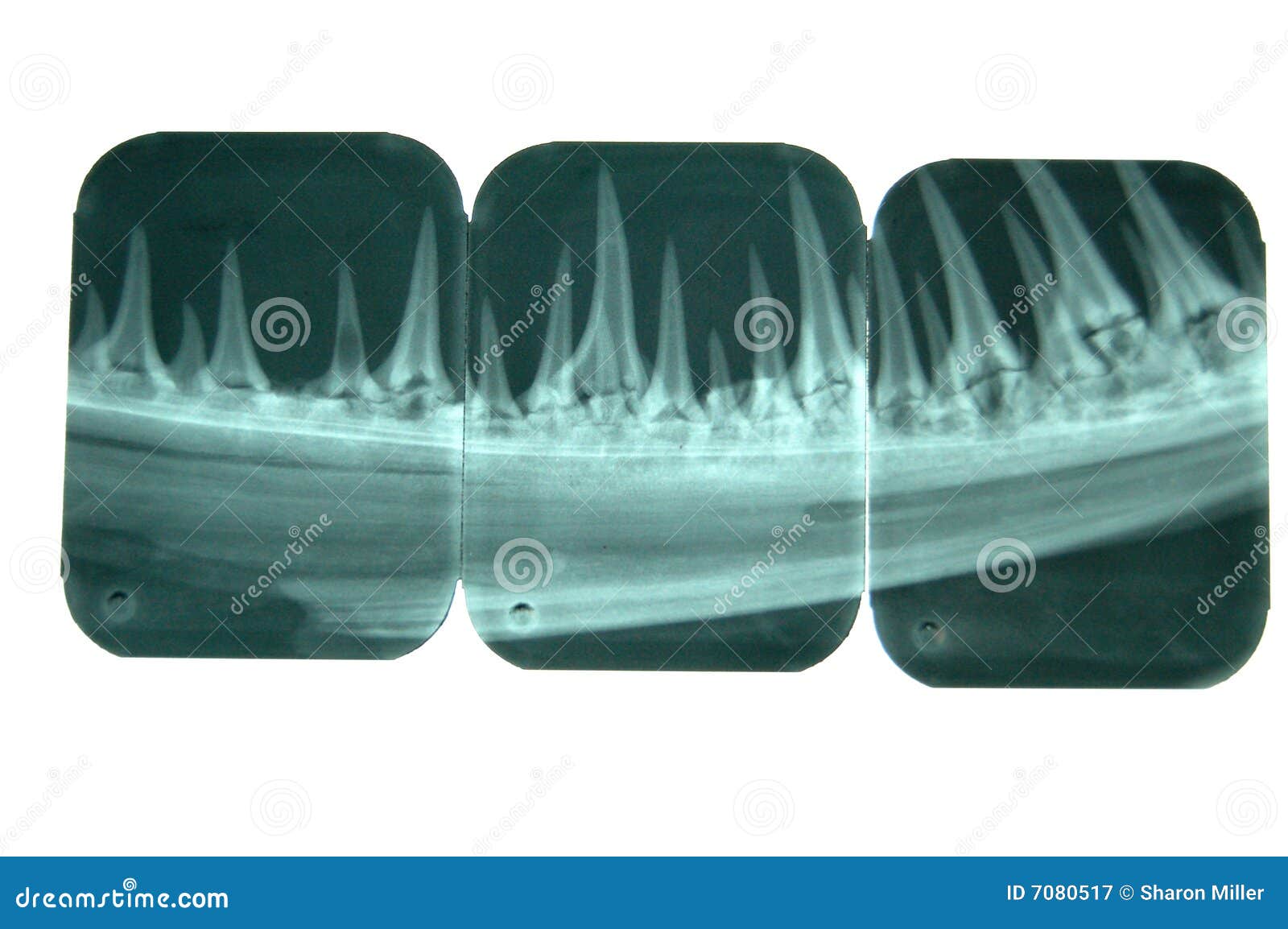 X-Rays of Sharp Teeth stock image. Image of dentist, model - 7080517