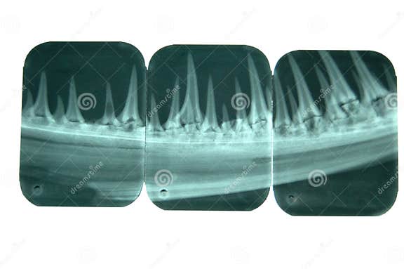 X-Rays of Sharp Teeth stock image. Image of dentist, model - 7080517