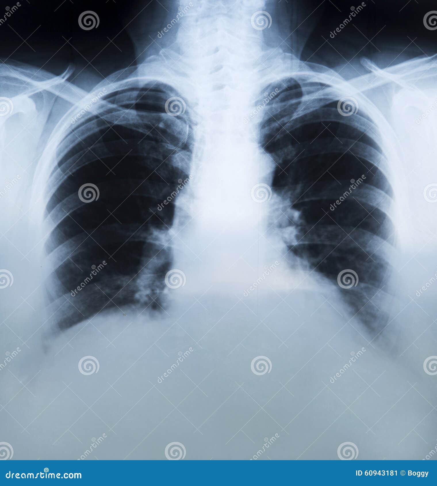 X rey recording stock image. Image of roentgen, patient - 60943181