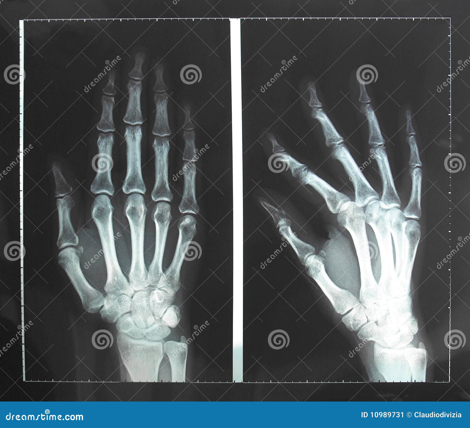 Xray stock image. Image of imaging, xray, medicine, bone - 10989731