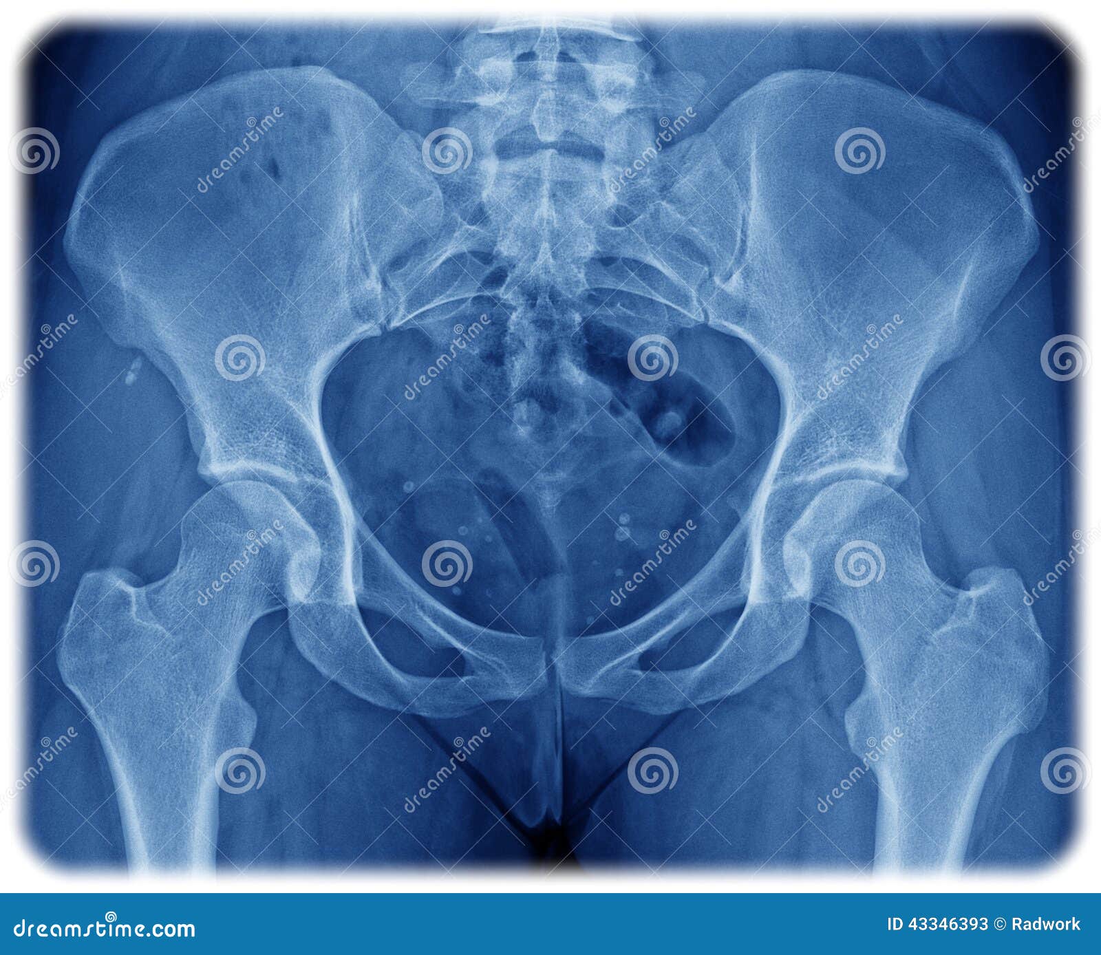 Xray Anterior Or Front View Of Full Human Respiratory System 3D ...