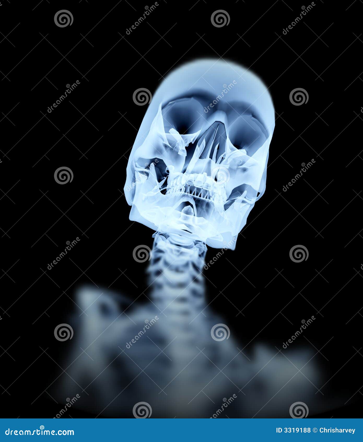 Scary Xray Stock Photos - Download 129 Royalty Free Photos