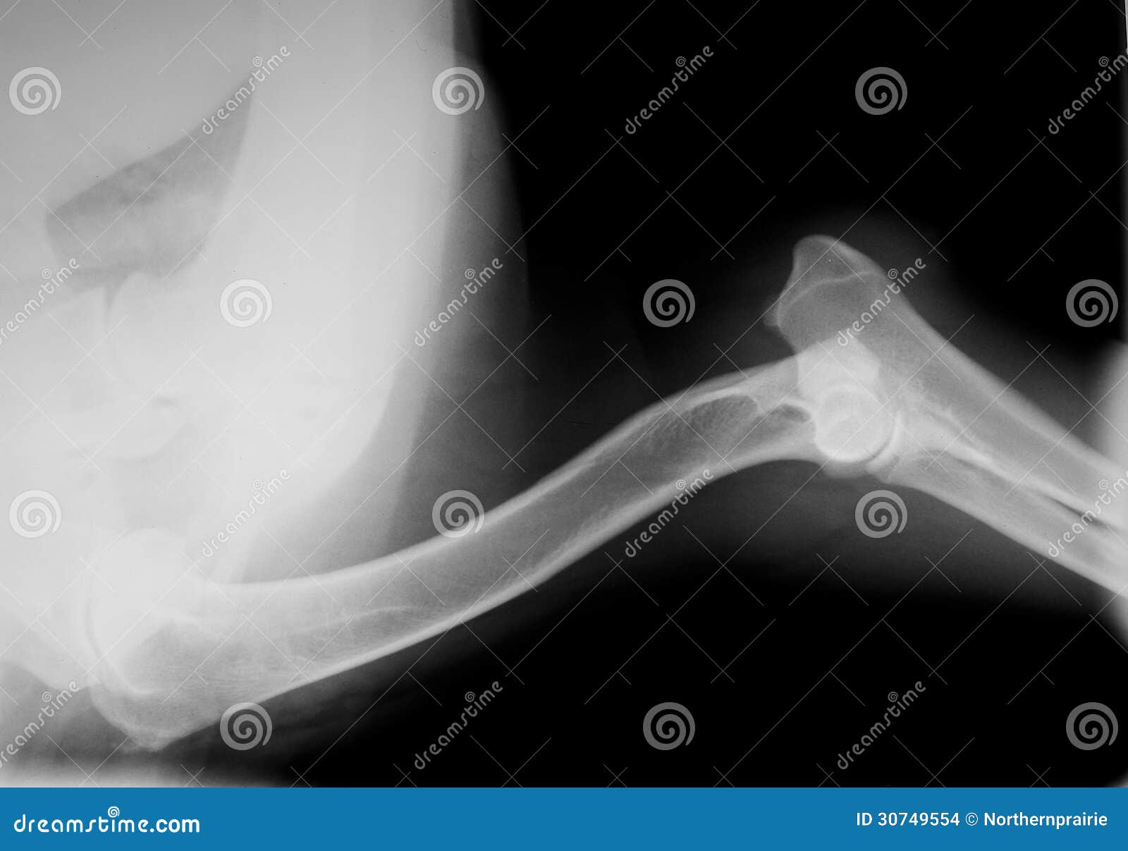 Xray of Dog Foreleg To Elbow Stock Photo - Image of radius, xray: 30749554