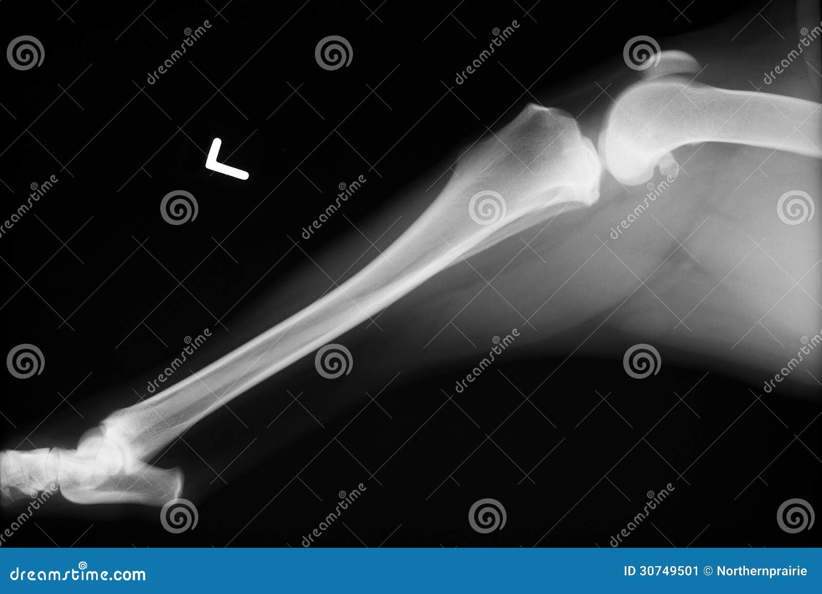 Xray of Dog Knee and Hind Limb Stock Image - Image of xray, medicine ...