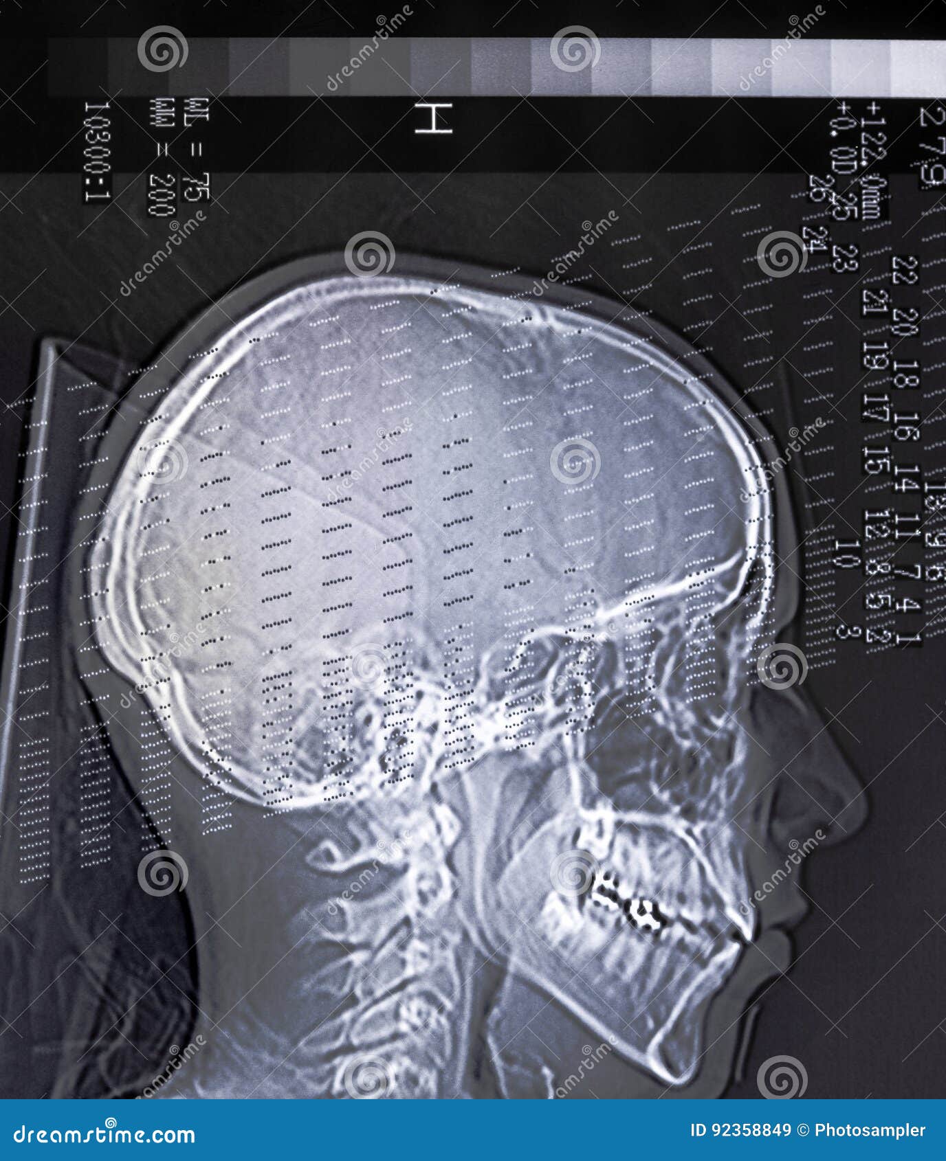 Xray head scan of a person stock image. Image of face - 92358849