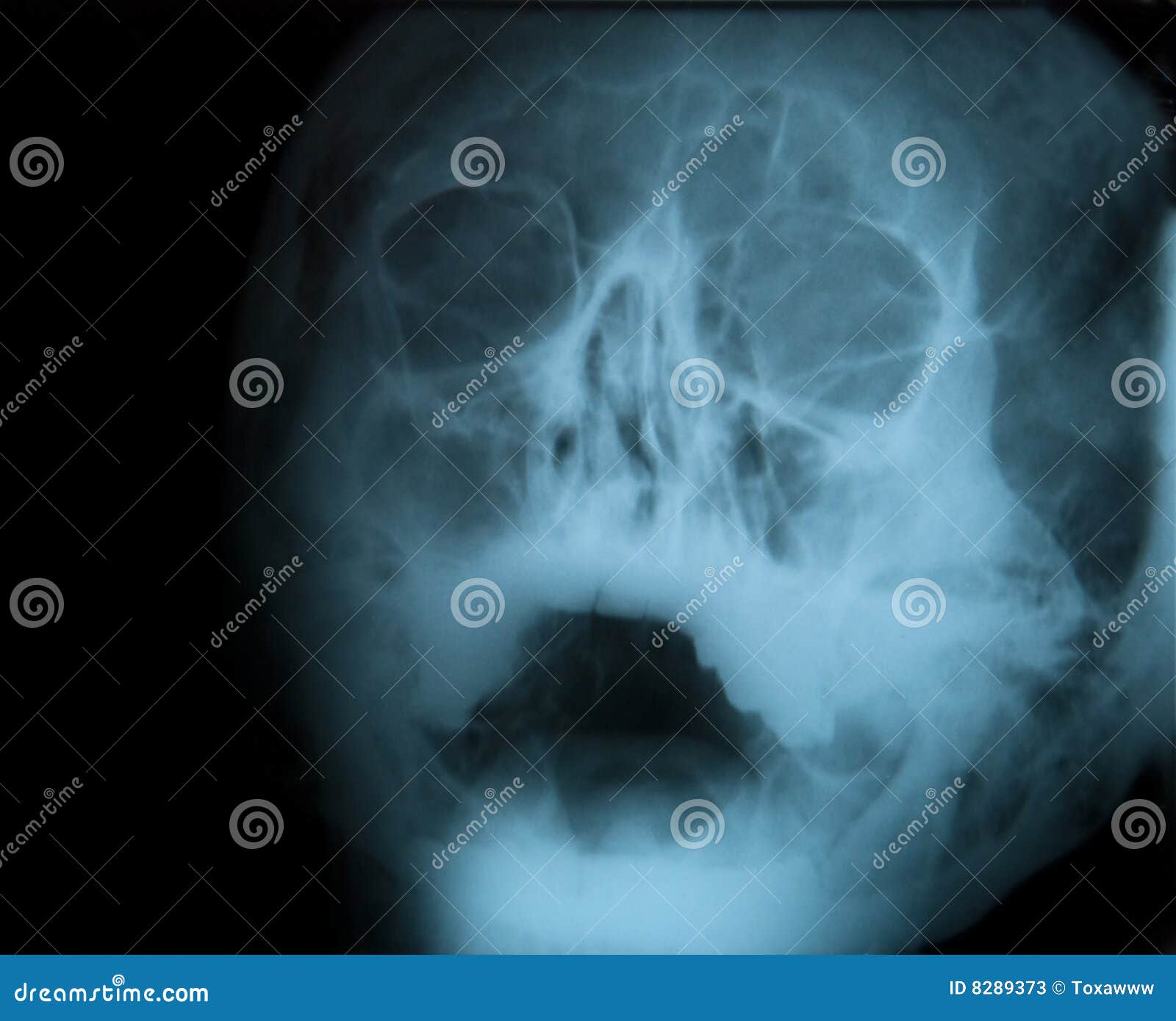 Xray image stock image. Image of mouth, hospital, nose - 8289373