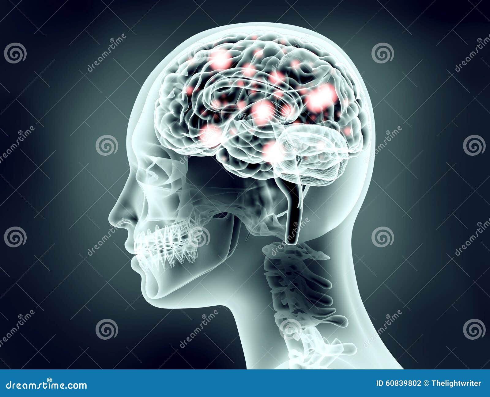 Xray Image of Human Head with Brain and Electric Pulses Stock ...