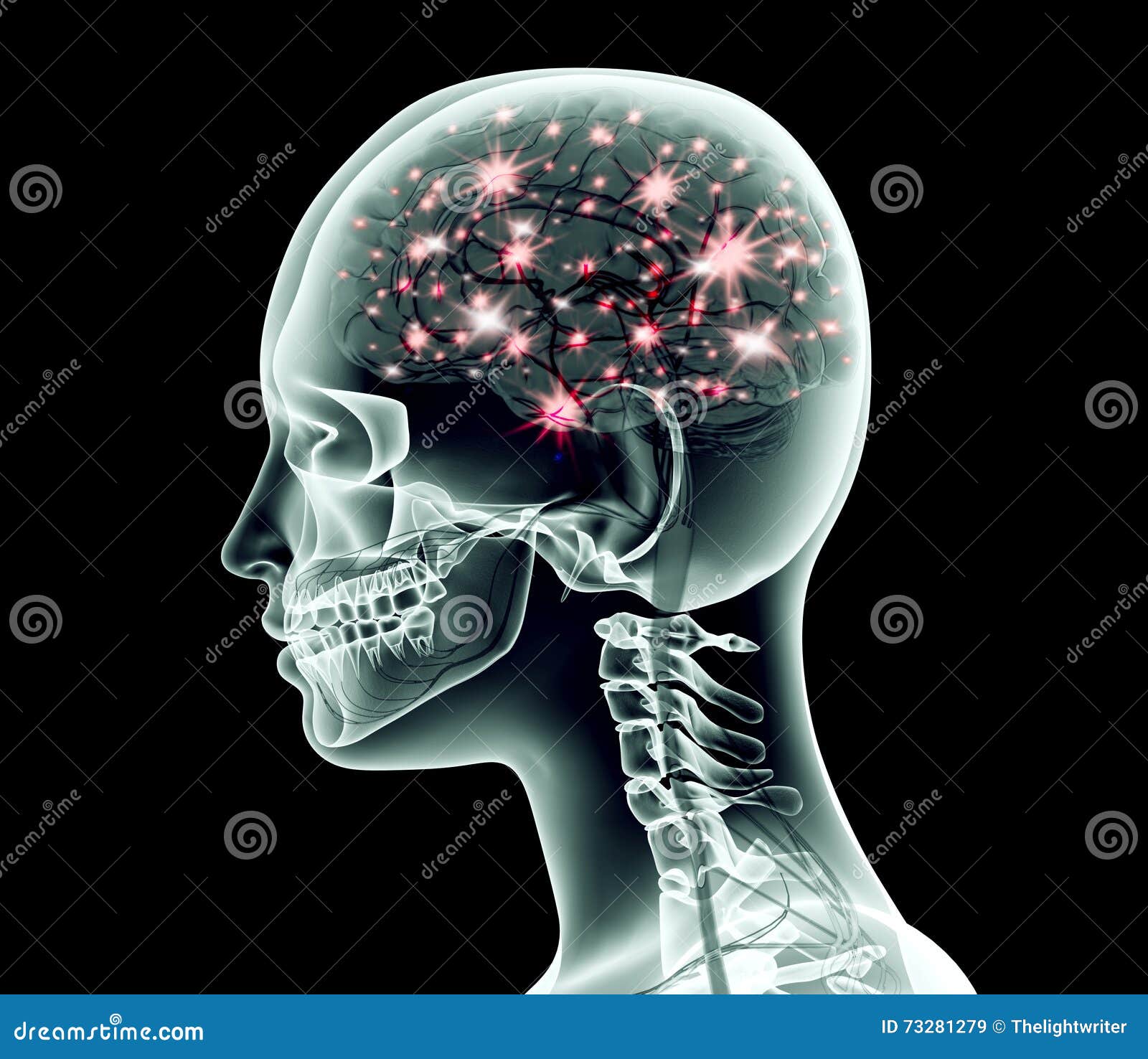 Xray Image of Human Head with Brain and Electric Pulses Stock ...