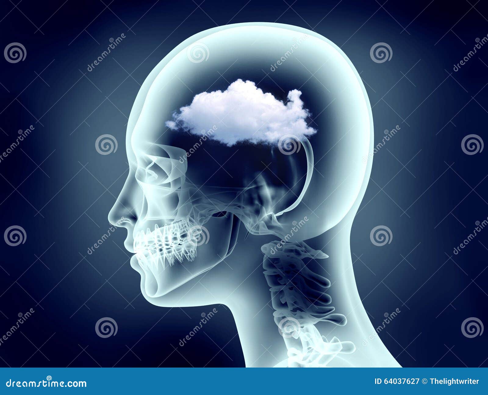 Xray Image of Human Head with Clouds Stock Image - Image of conscious ...