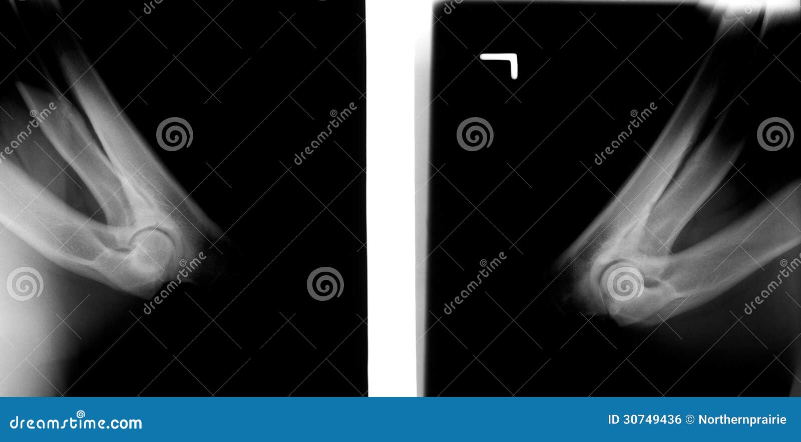 Xrays of dog foreleg stock photo. Image of canine, radiograph - 30749436