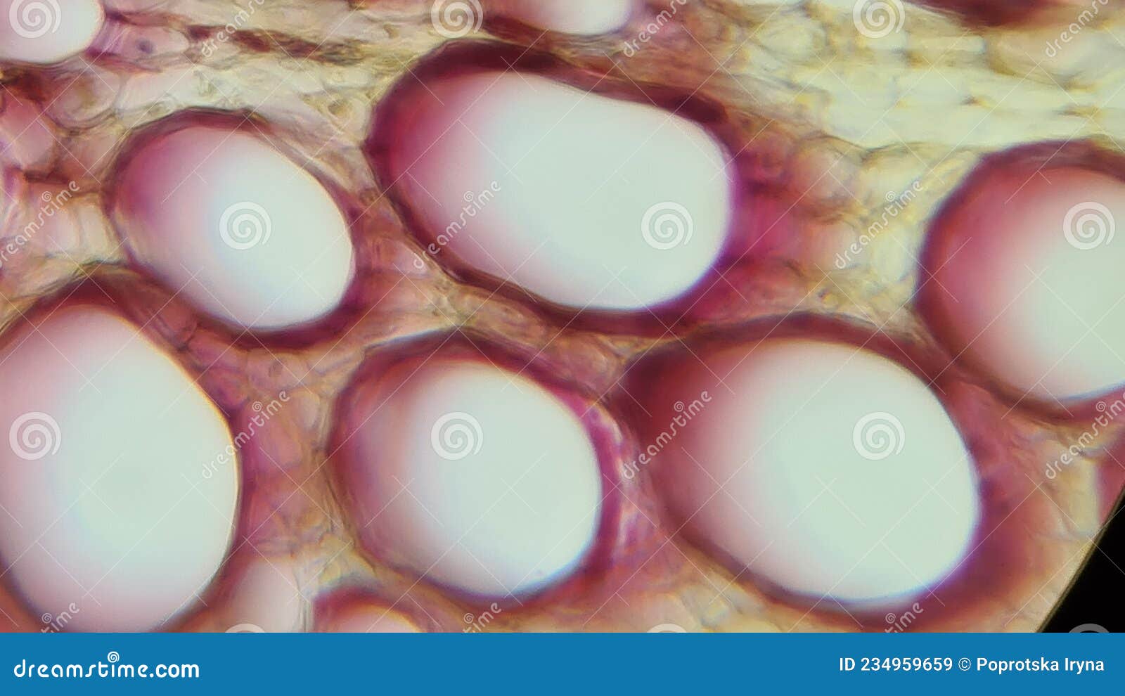 Xylem on Beet Root Preparation Under a Microscope Stock Image - Image ...