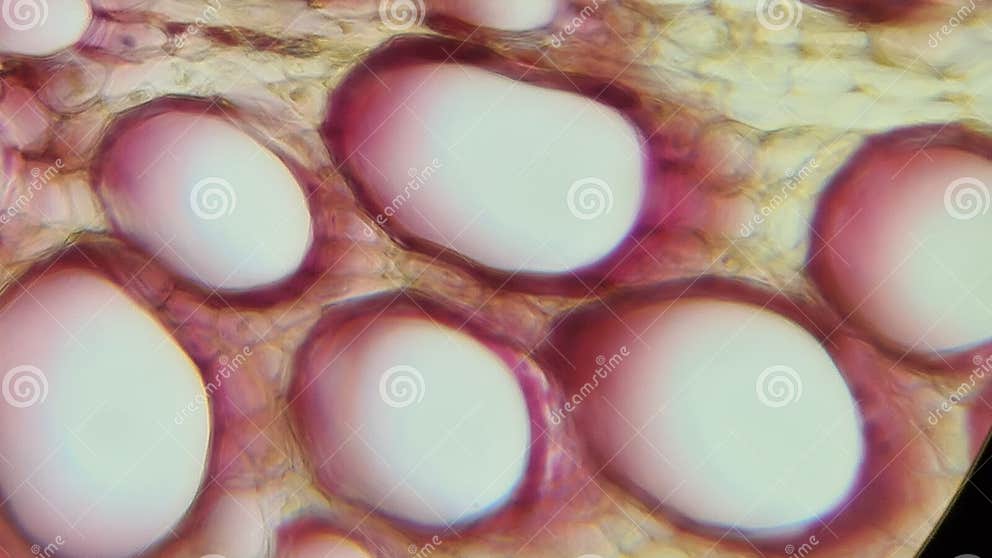 Xylem on Beet Root Preparation Under a Microscope Stock Image - Image ...