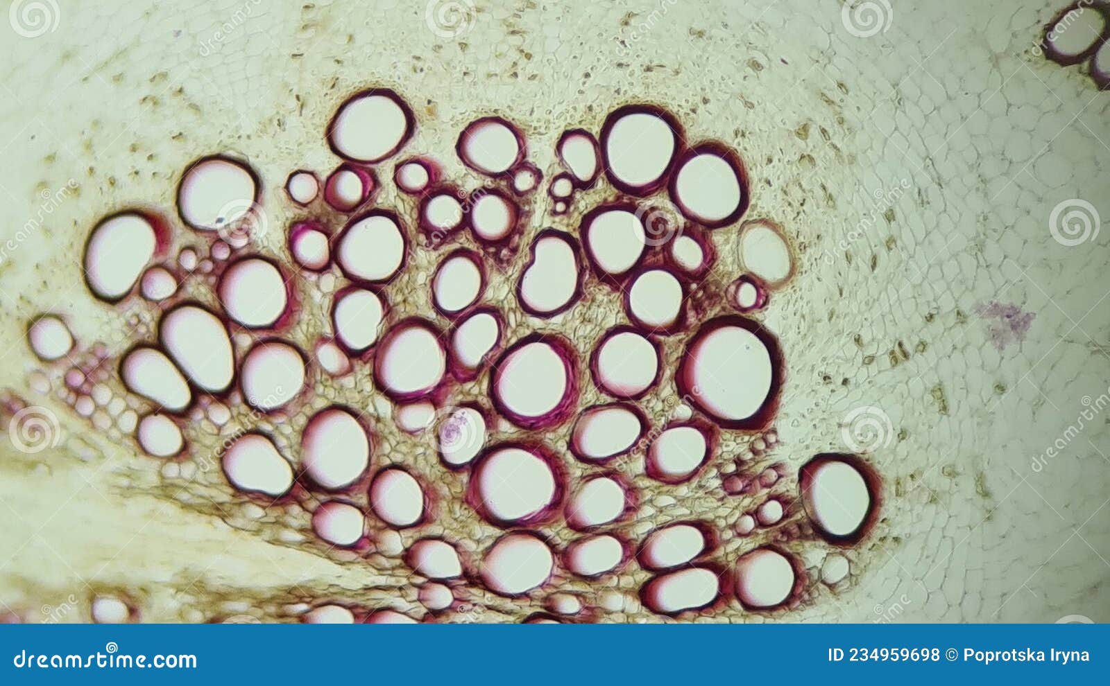 Xylem and Other Tissues of Beet Root Under a Microscope Stock Photo ...