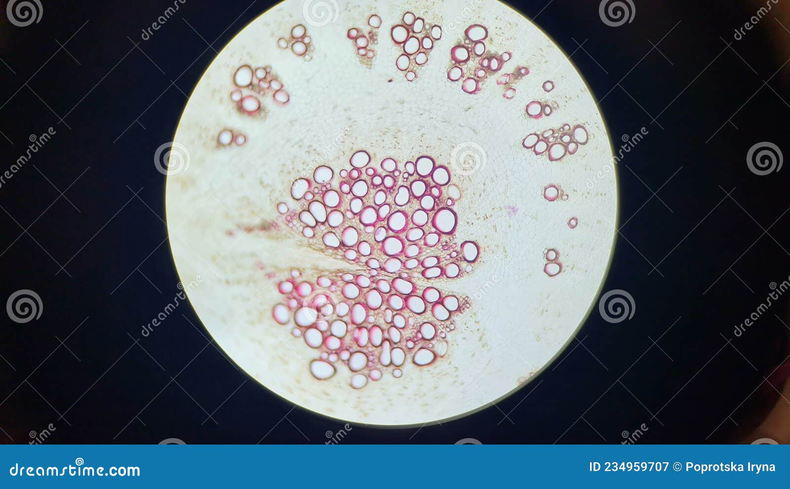 Xylem and Other Tissues of Beet Root Under a Microscope Stock Image ...