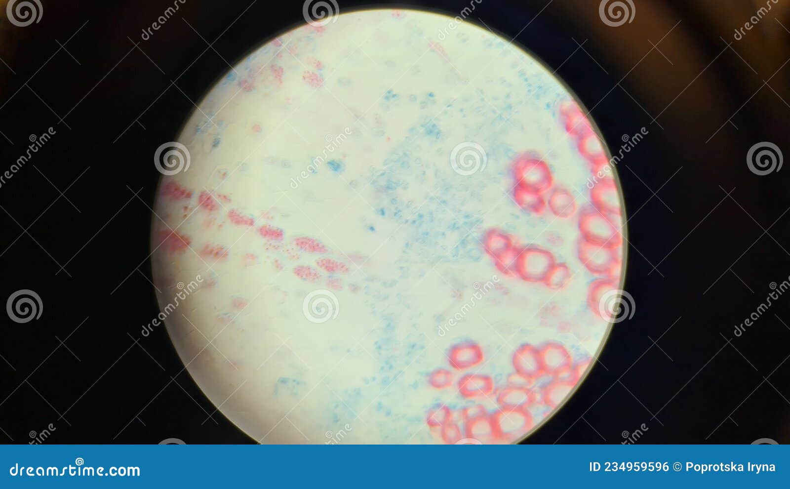 Xylem And Phloem Microscope Hd