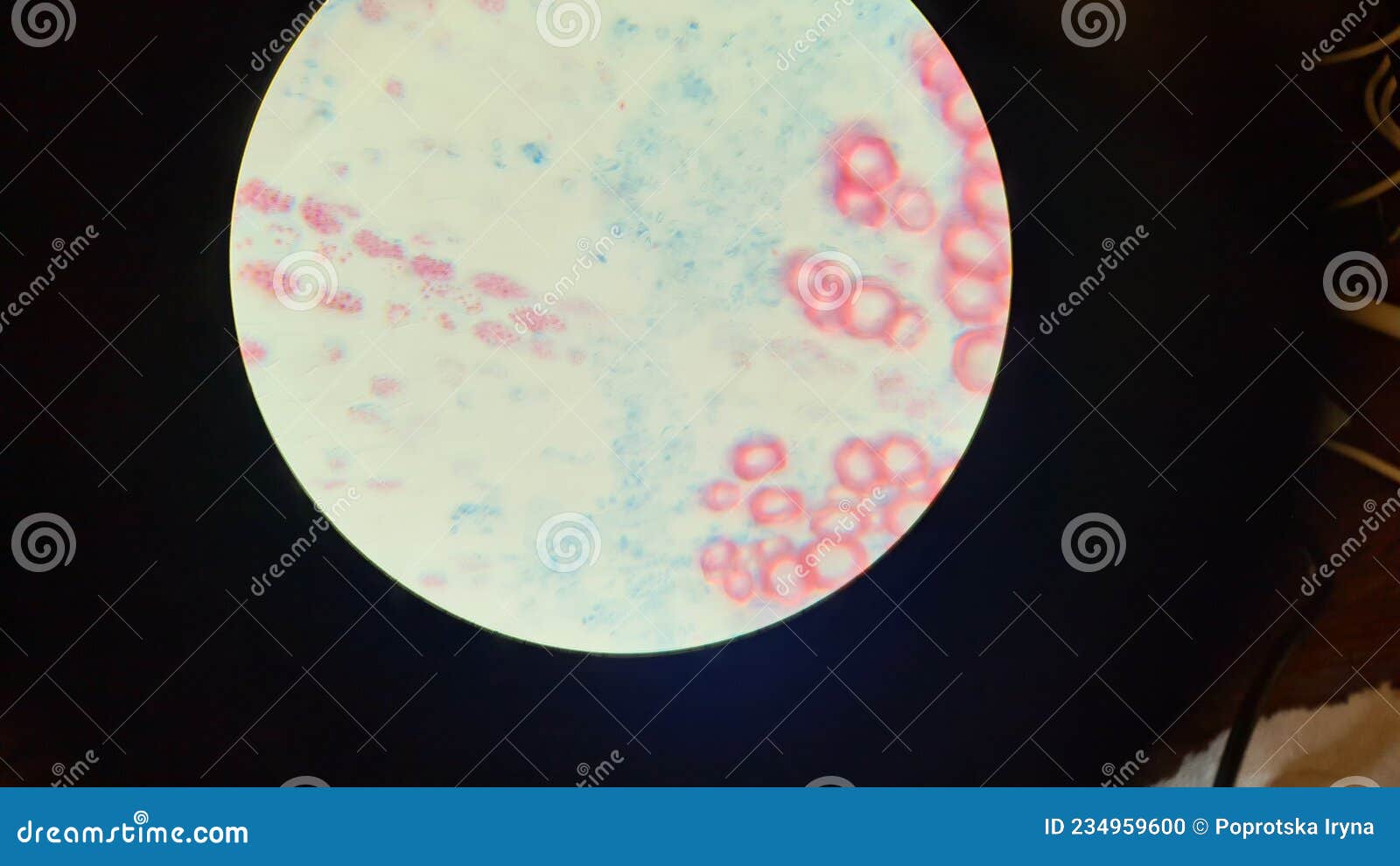 Xylem Under The Microscope