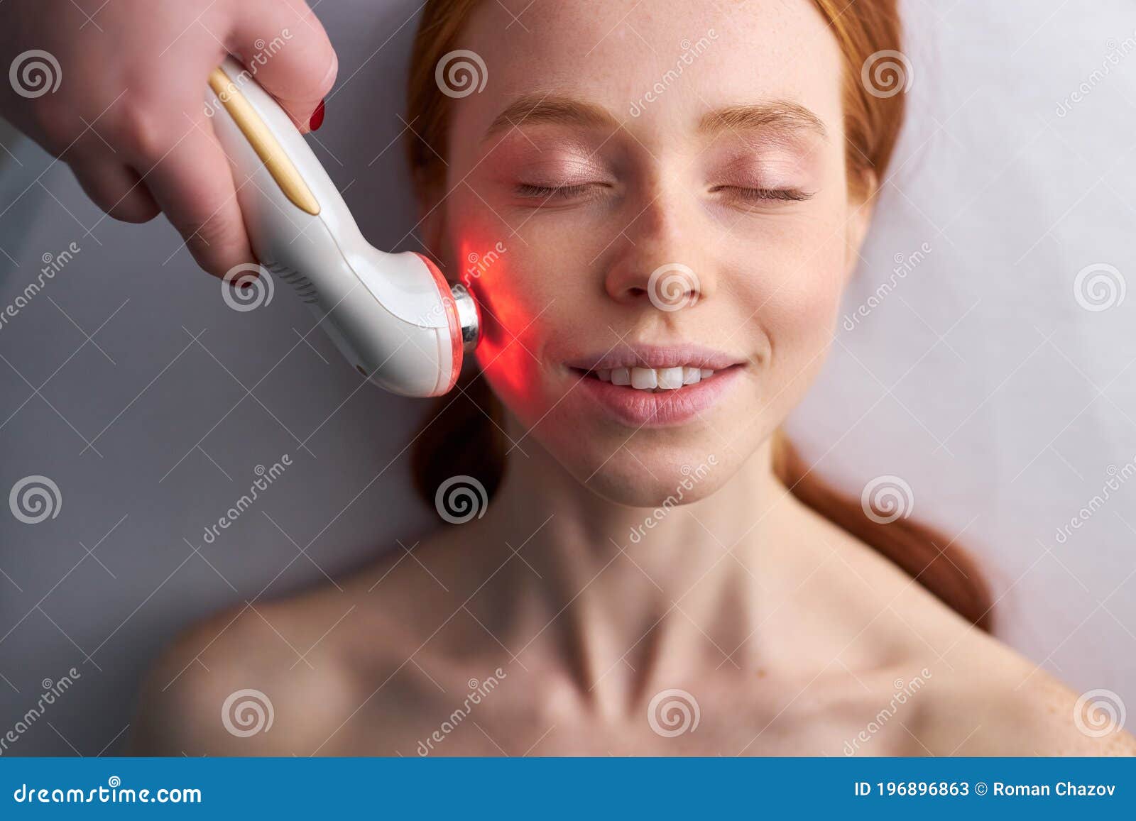 20 25 Years Old Woman Receiving A Non Surgical Rejuvenation Procedure