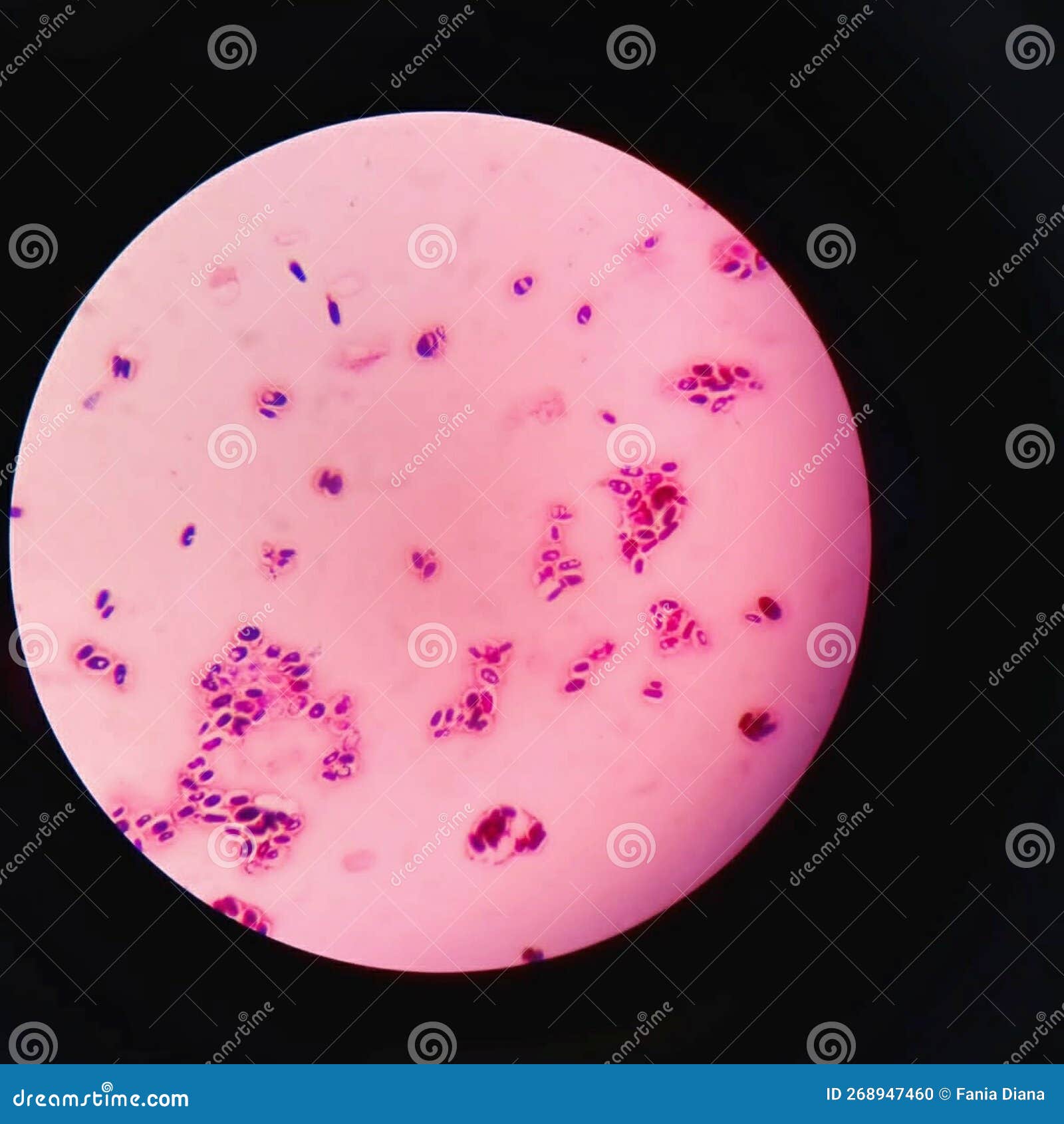 Yeast Cells in Gram Stain Fine with Microscope. Stock Photo - Image of ...