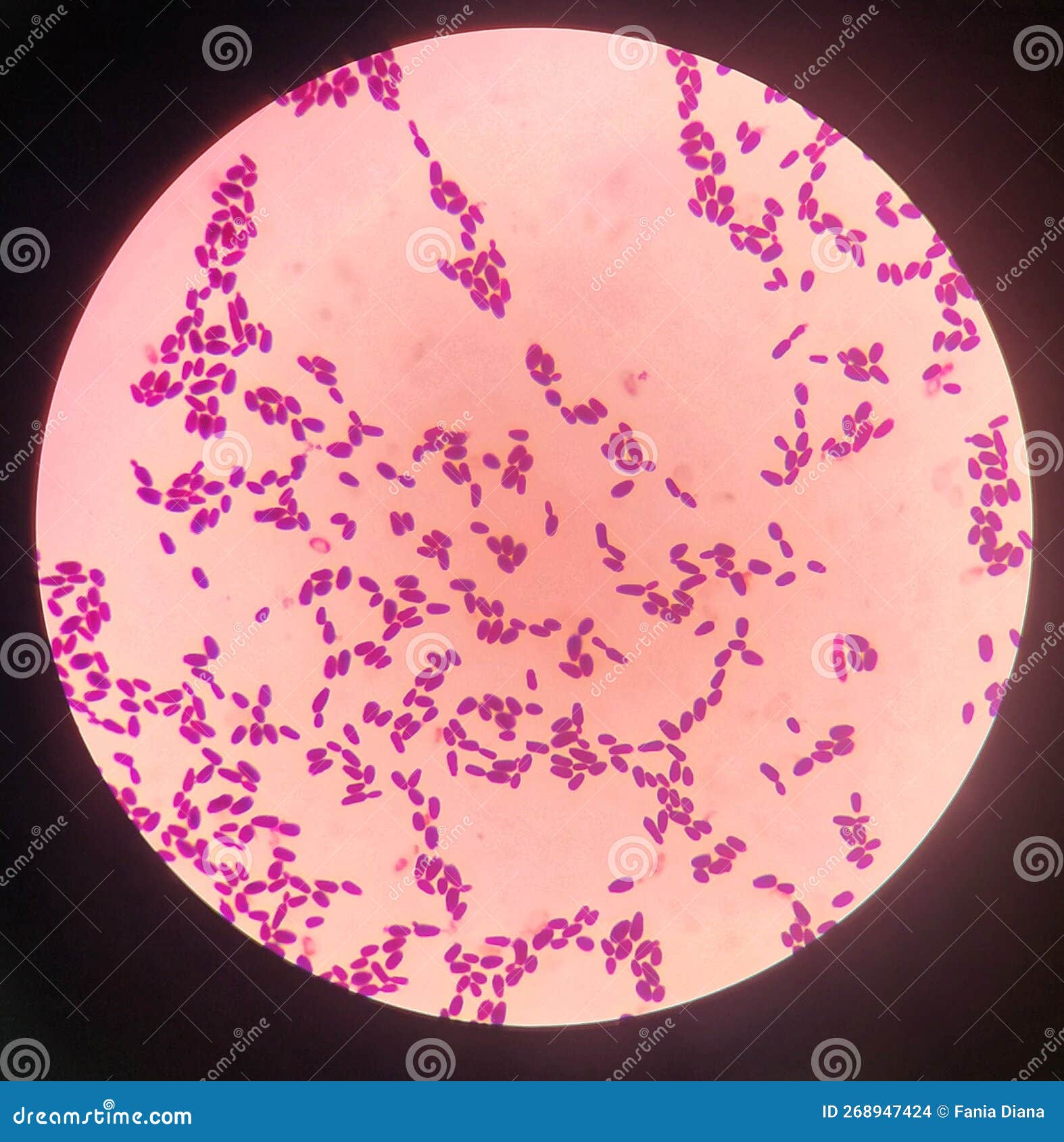Yeast Cells in Gram Stain (with Gentian Violet) Viewed Under a ...