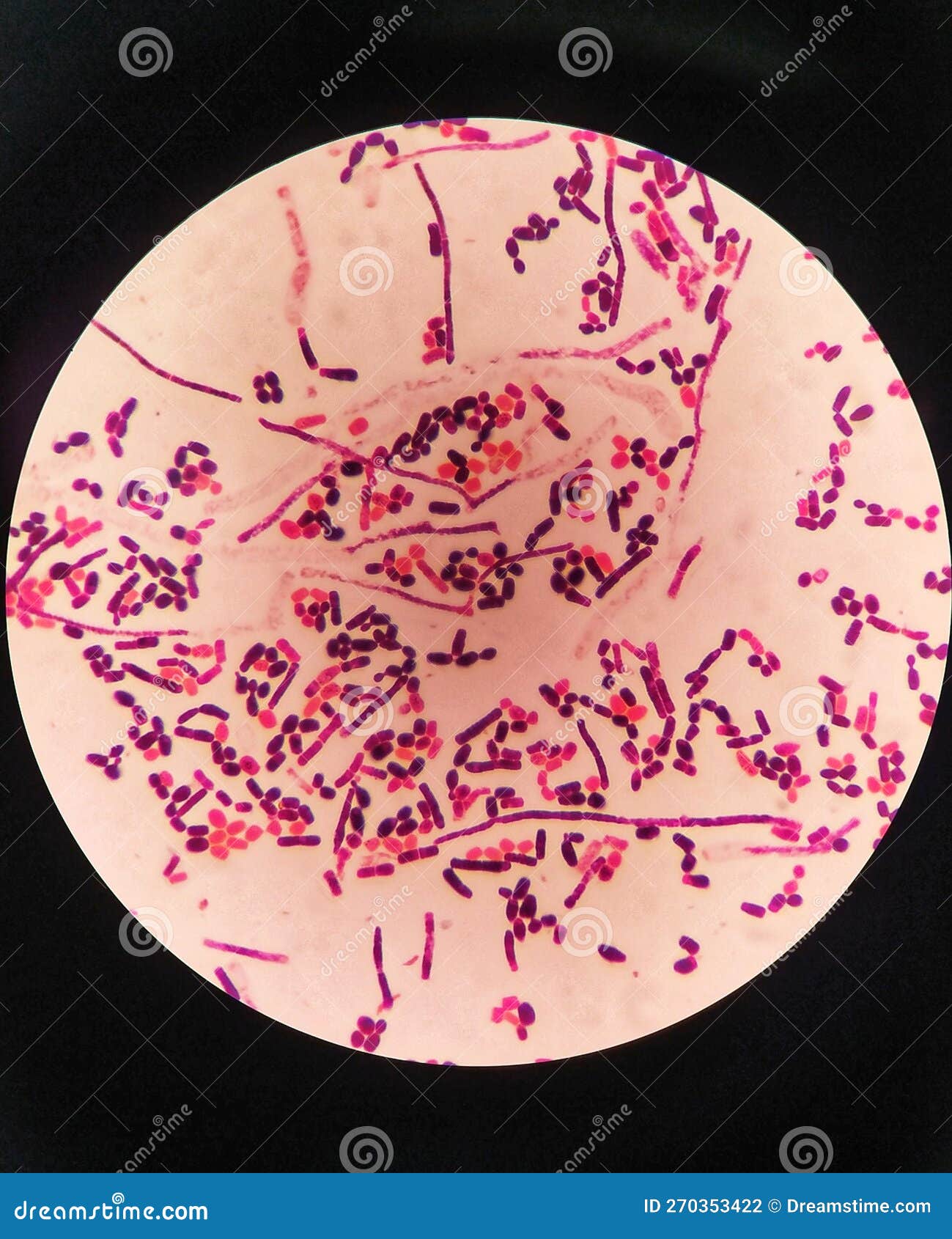Yeast Cells and Hyphae in Gram Stain Fine with Microscope. Stock Photo ...