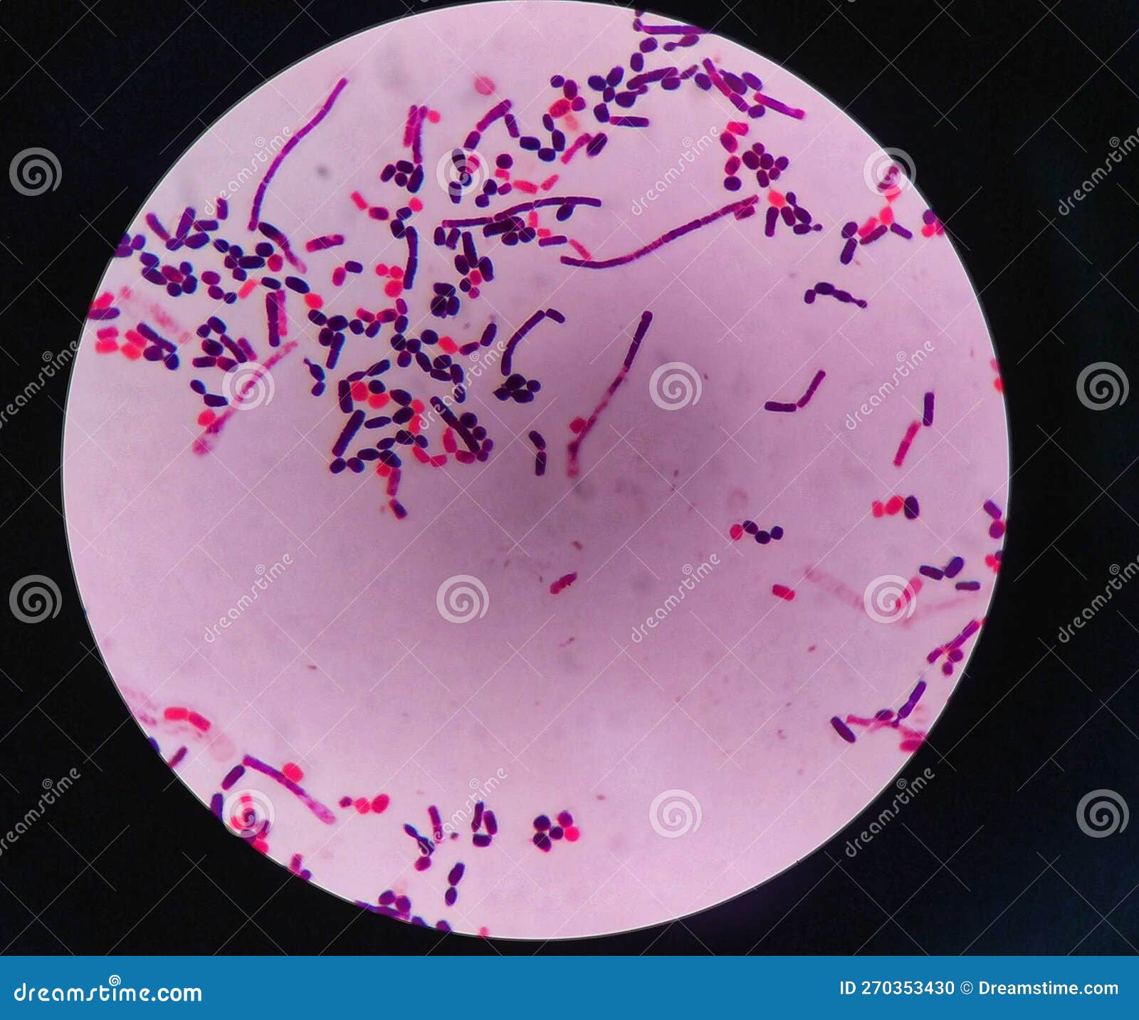 Yeast Cells and Hyphae in Gram Stain Fine with Microscope. Stock Photo ...