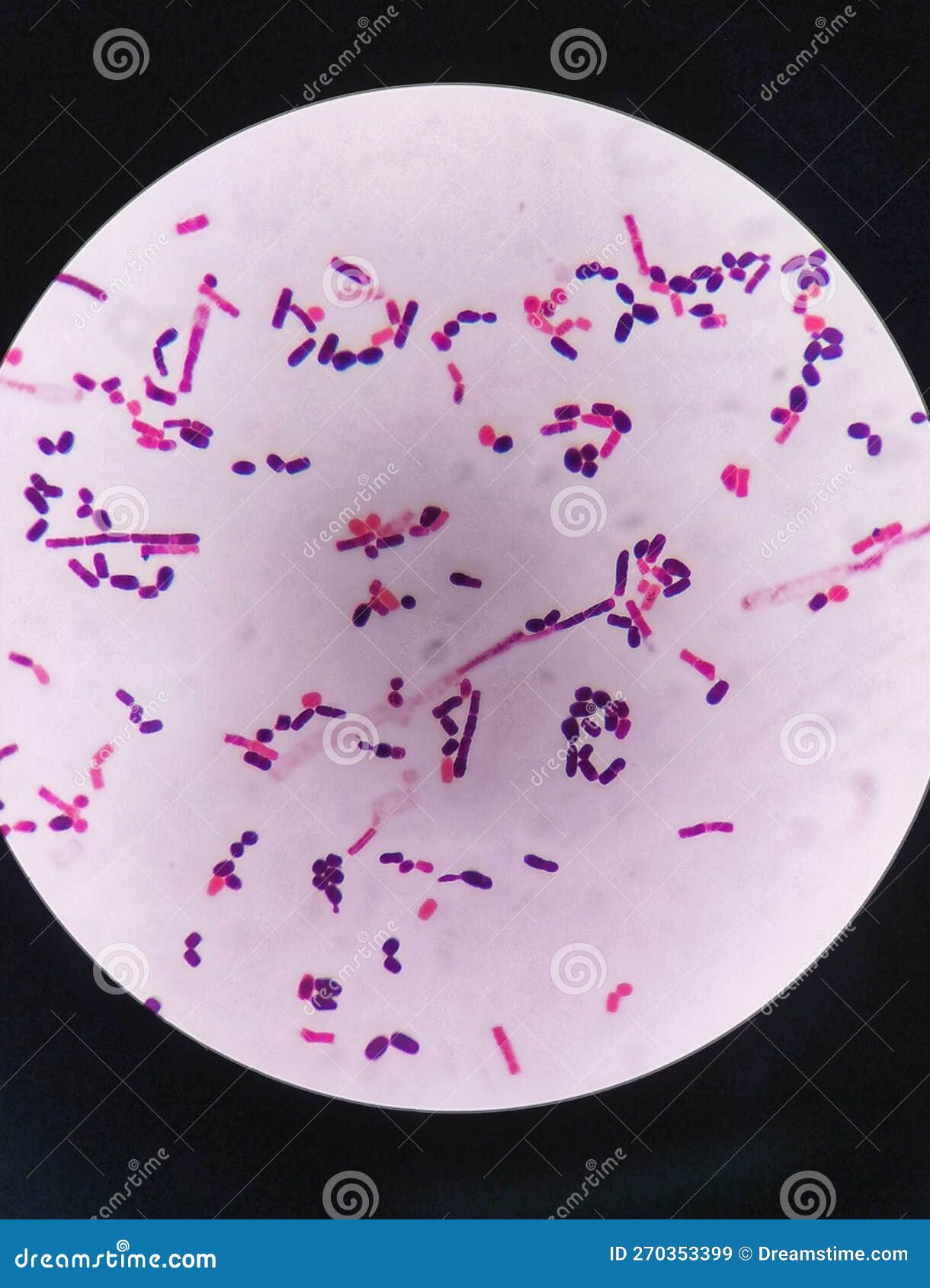 Yeast Cells And Hyphae In Gram Stain Fine With Microscope Stock Image Image Of Disease Fever