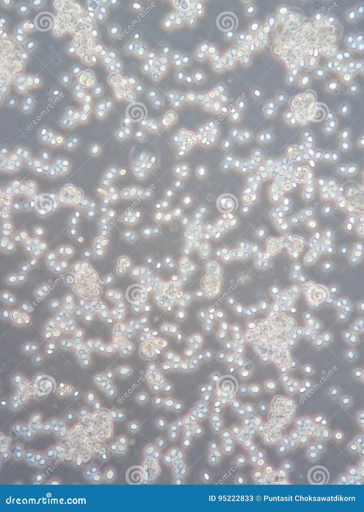 Yeast Cells In Gram Stain Fine With Microscope. Stock Photo ...