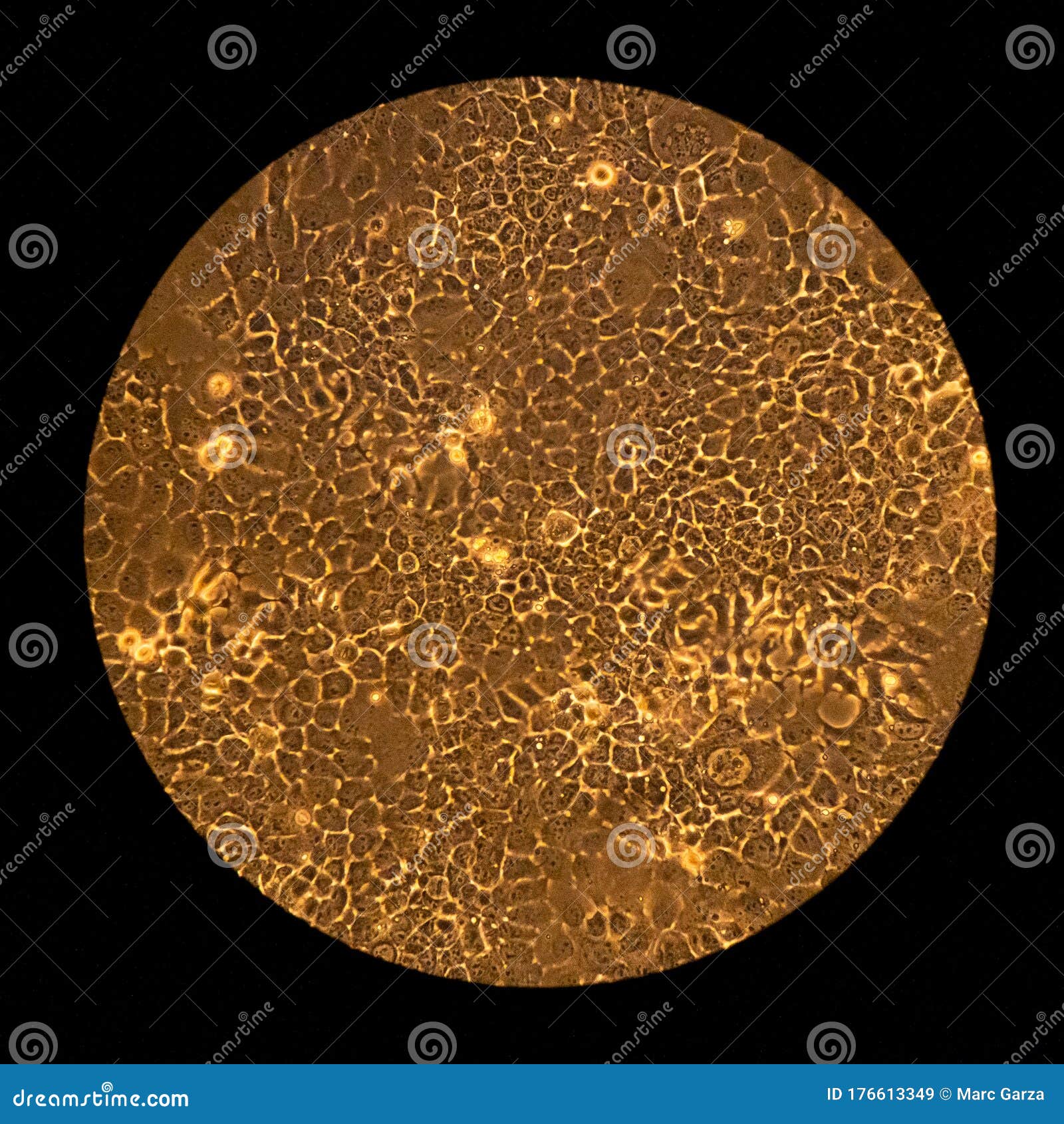 Yeast Growth Under a Microscope Stock Image - Image of growth ...