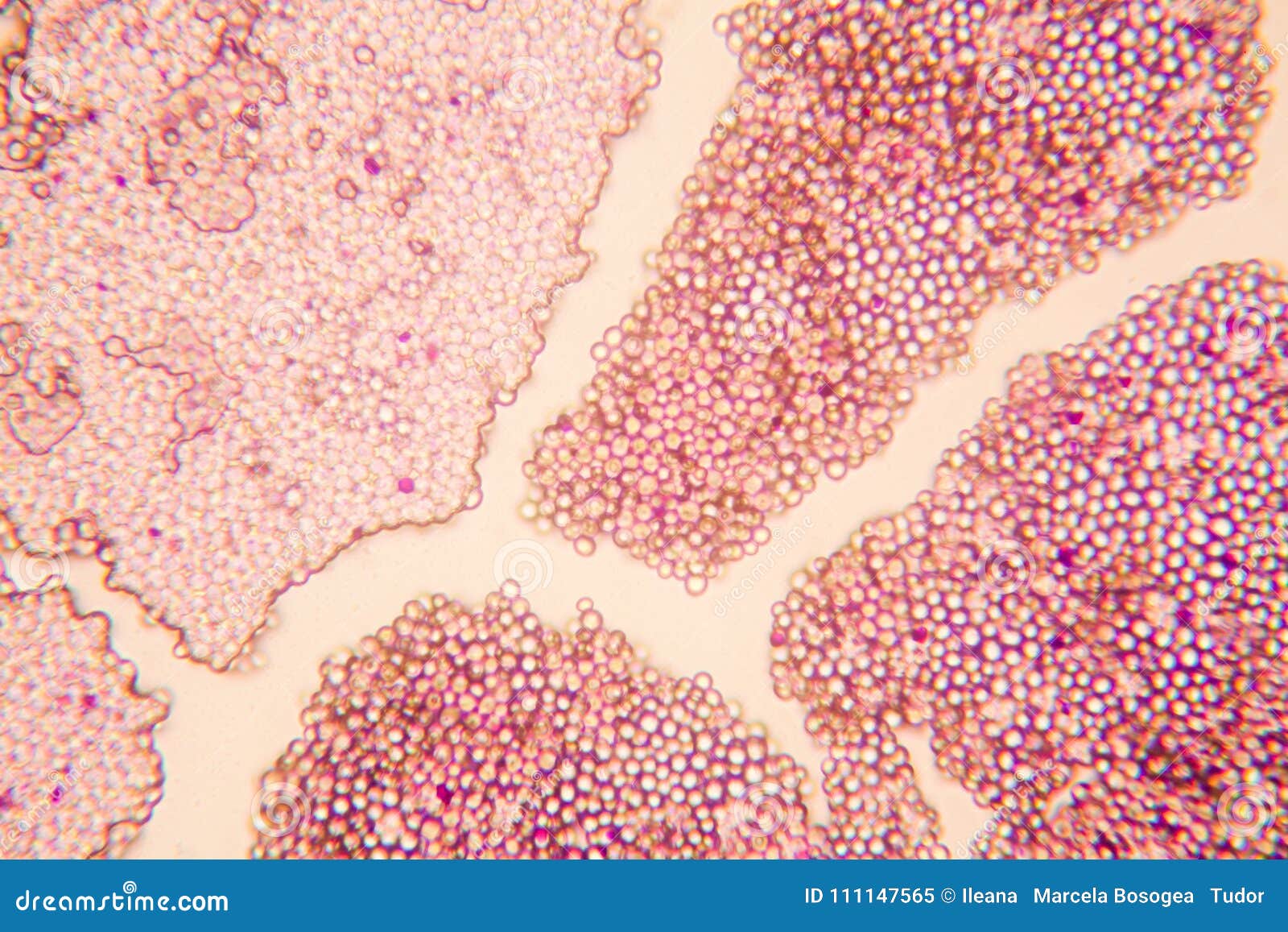 Candida Albicans Microscope Slide