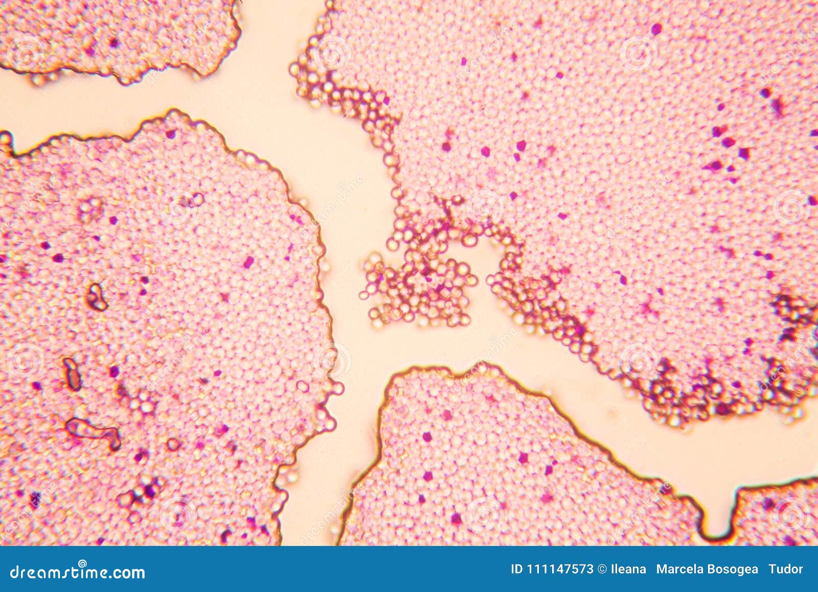 Yeast at the microscope stock image. Image of medicine - 111147573