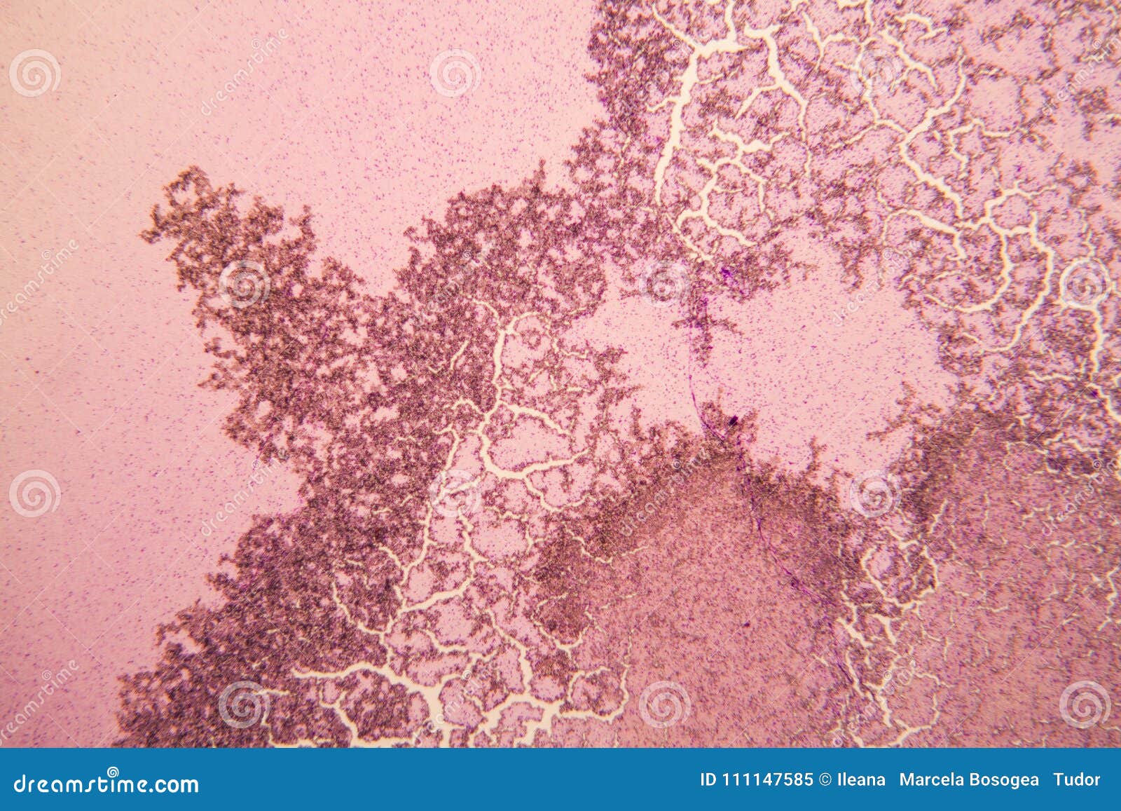 Yeast at the microscope stock image. Image of fungi - 111147585