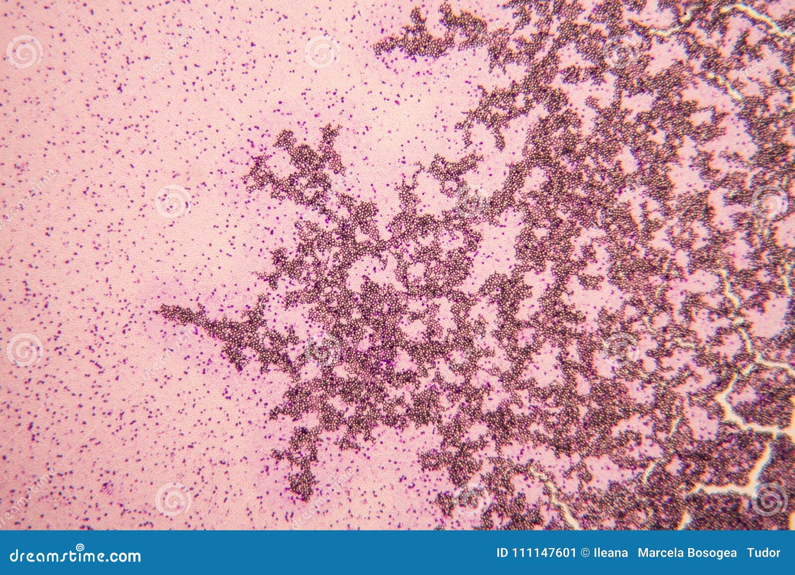 Yeast at the microscope stock image. Image of biology - 111147601