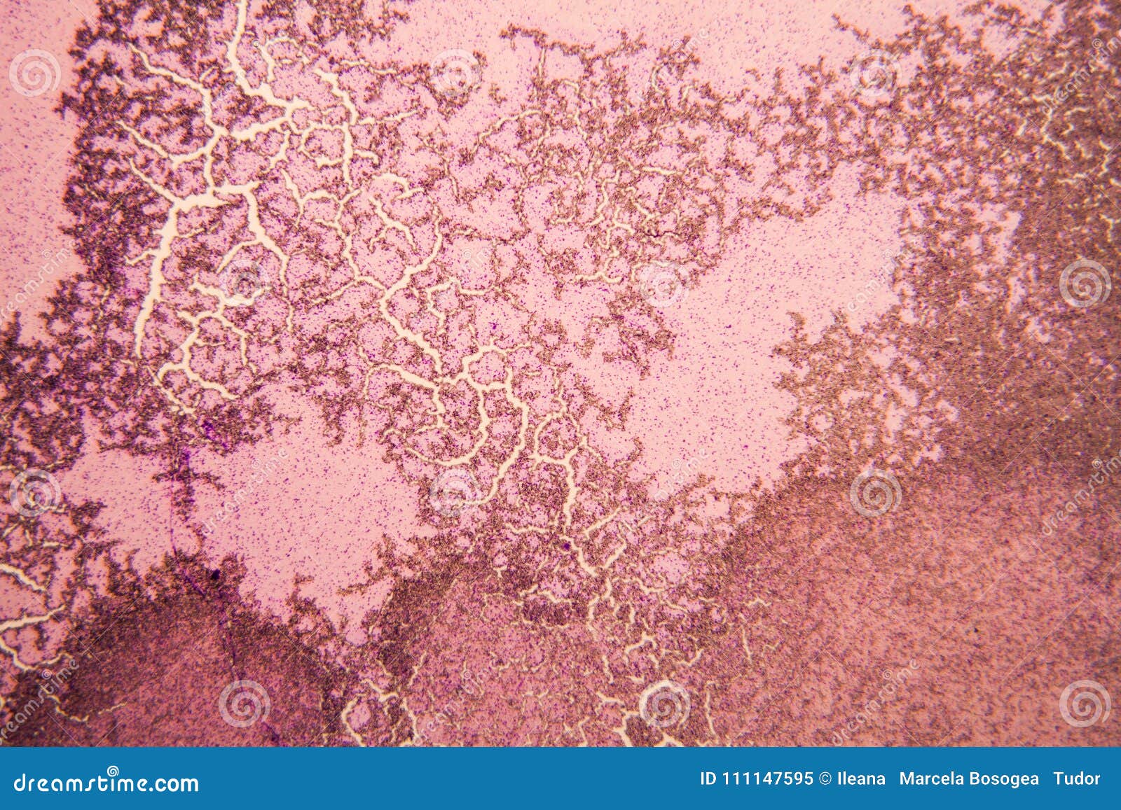 Yeast at the microscope stock image. Image of form, bread - 111147595
