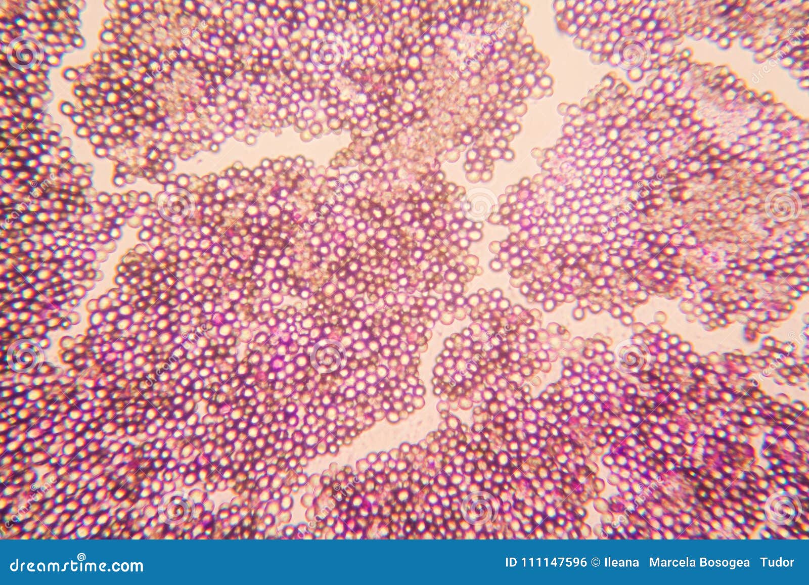 Yeast at the microscope stock photo. Image of disease - 111147596