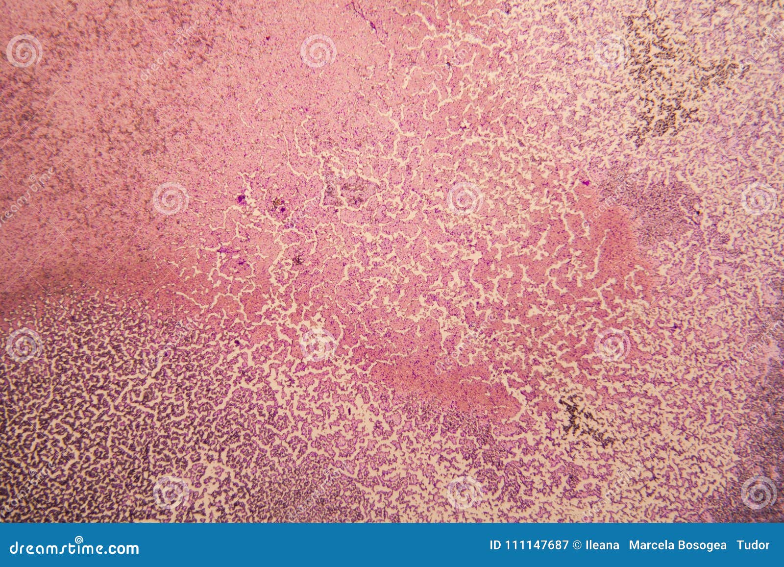 Yeast at the microscope stock image. Image of medicine - 111147687