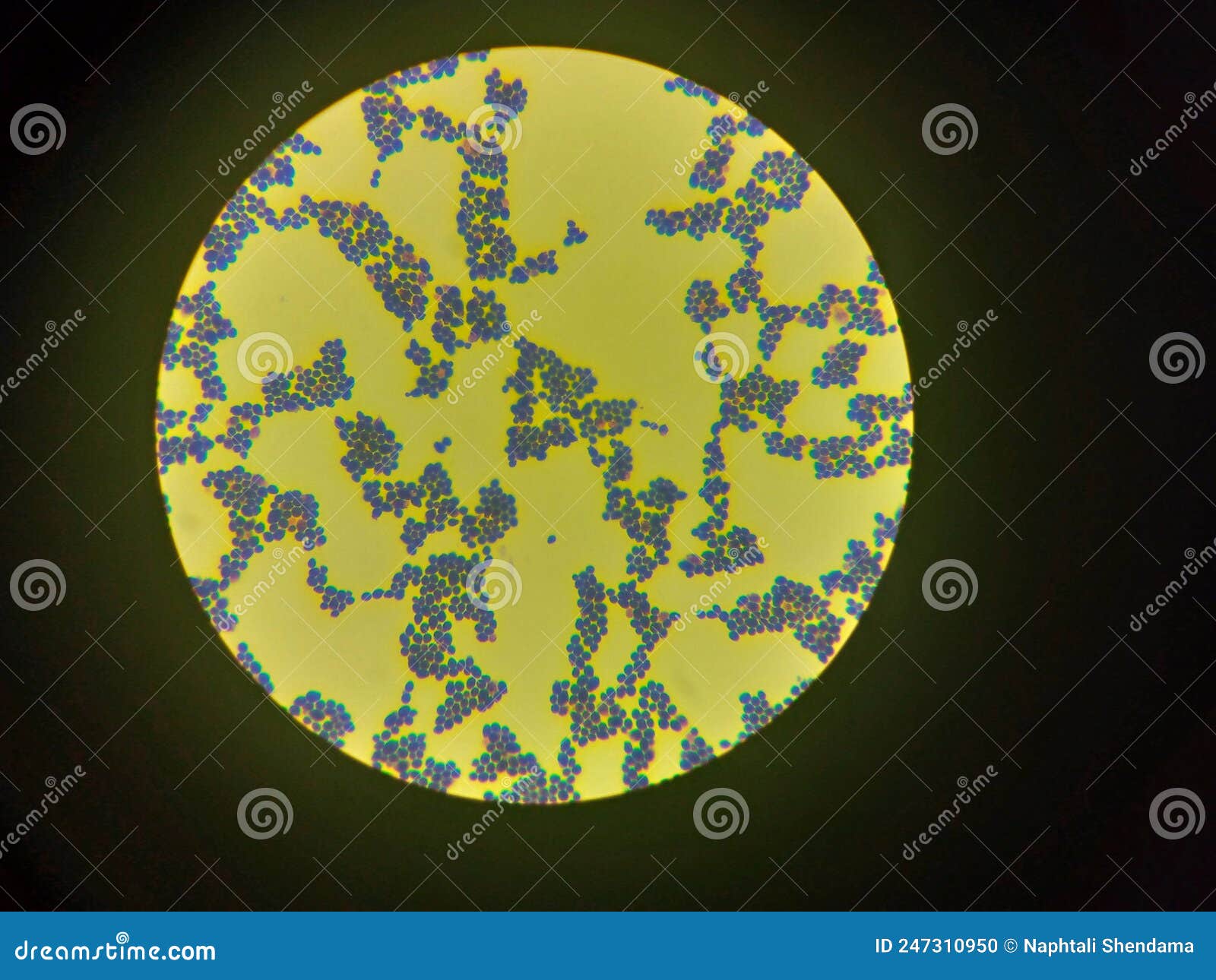 Yeast under microscope stock photo. Image of yeast, glass - 247310950