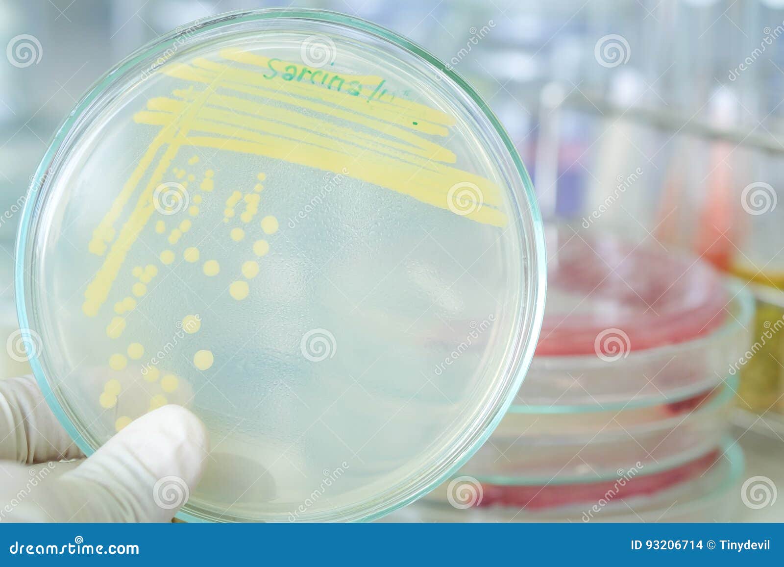 Yellow colony of bacteria stock photo. Image of growth - 93206714