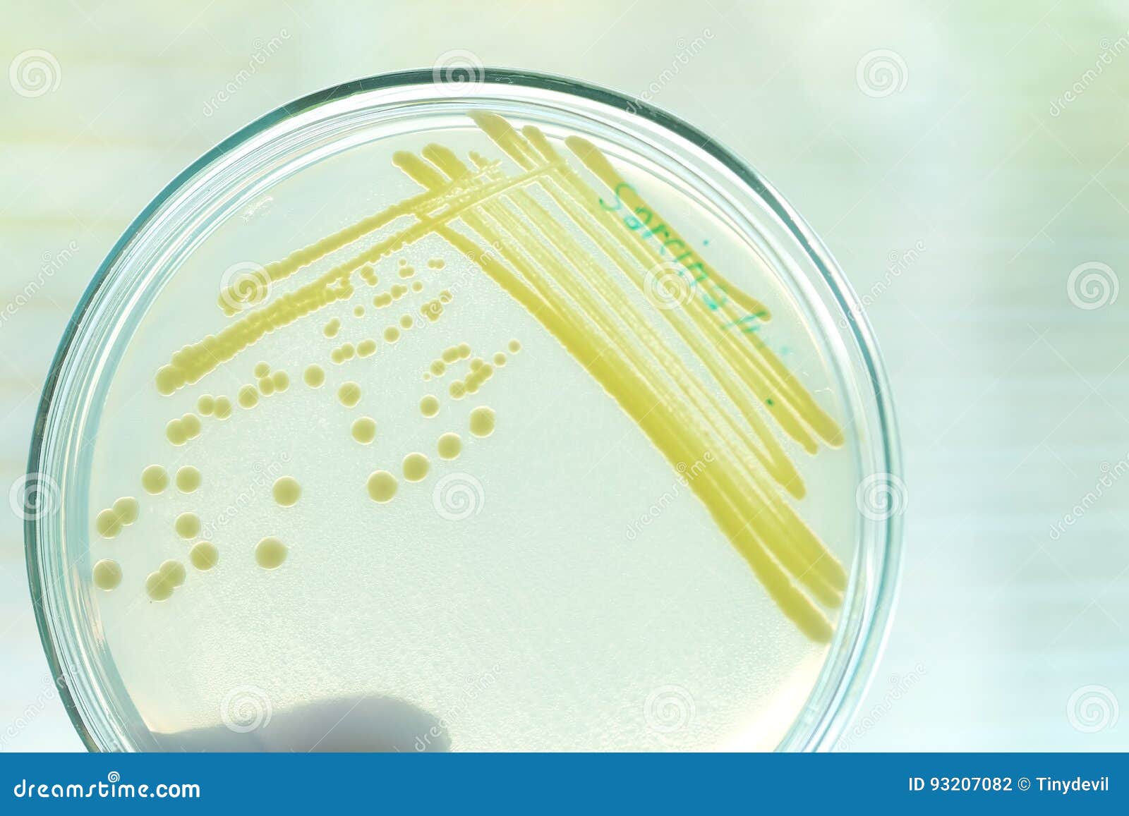Yellow colony of bacteria stock photo. Image of microbiology - 93207082