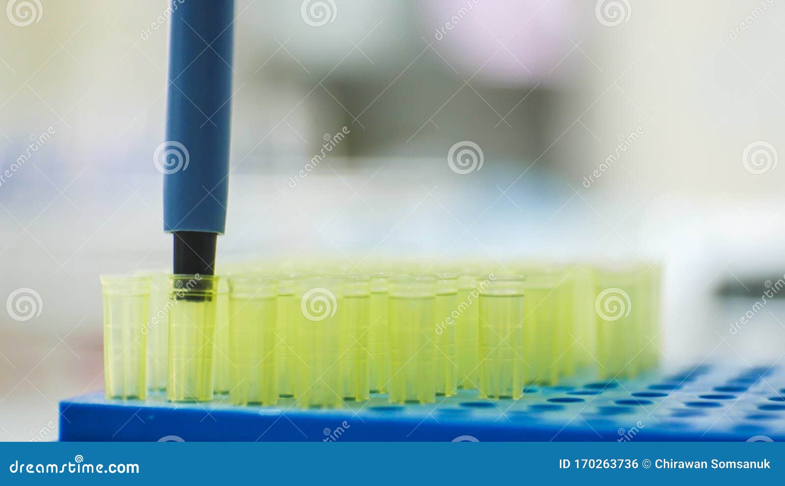 Yellow Pipette Tip in Blue Box Stock Photo - Image of chemical ...