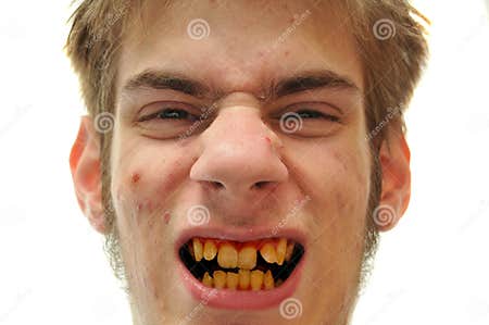 Yellow Teeth stock image. Image of acne, care, teeth - 11658263